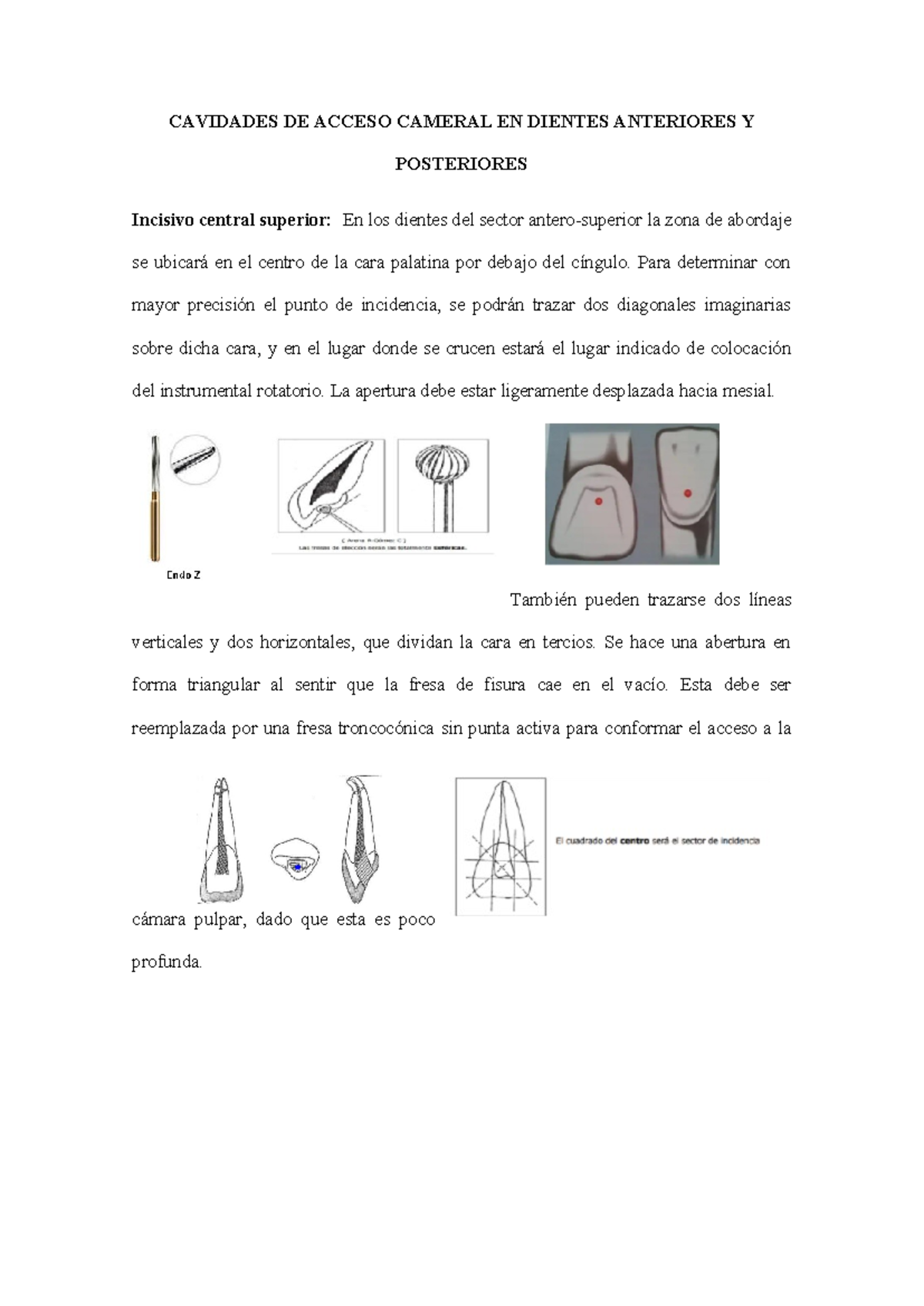 Cavidades DE Acceso Cameral EN Dientes Anteriores Y Posteriores ...