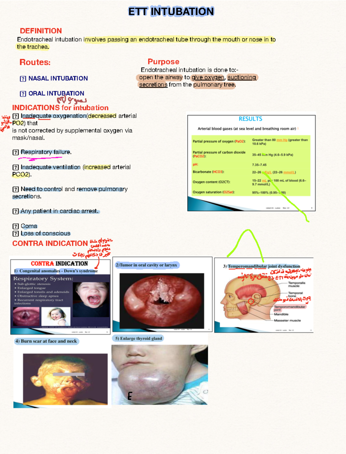 5- ETT Intubation - DEFINITION Endotracheal intubation involves passing ...