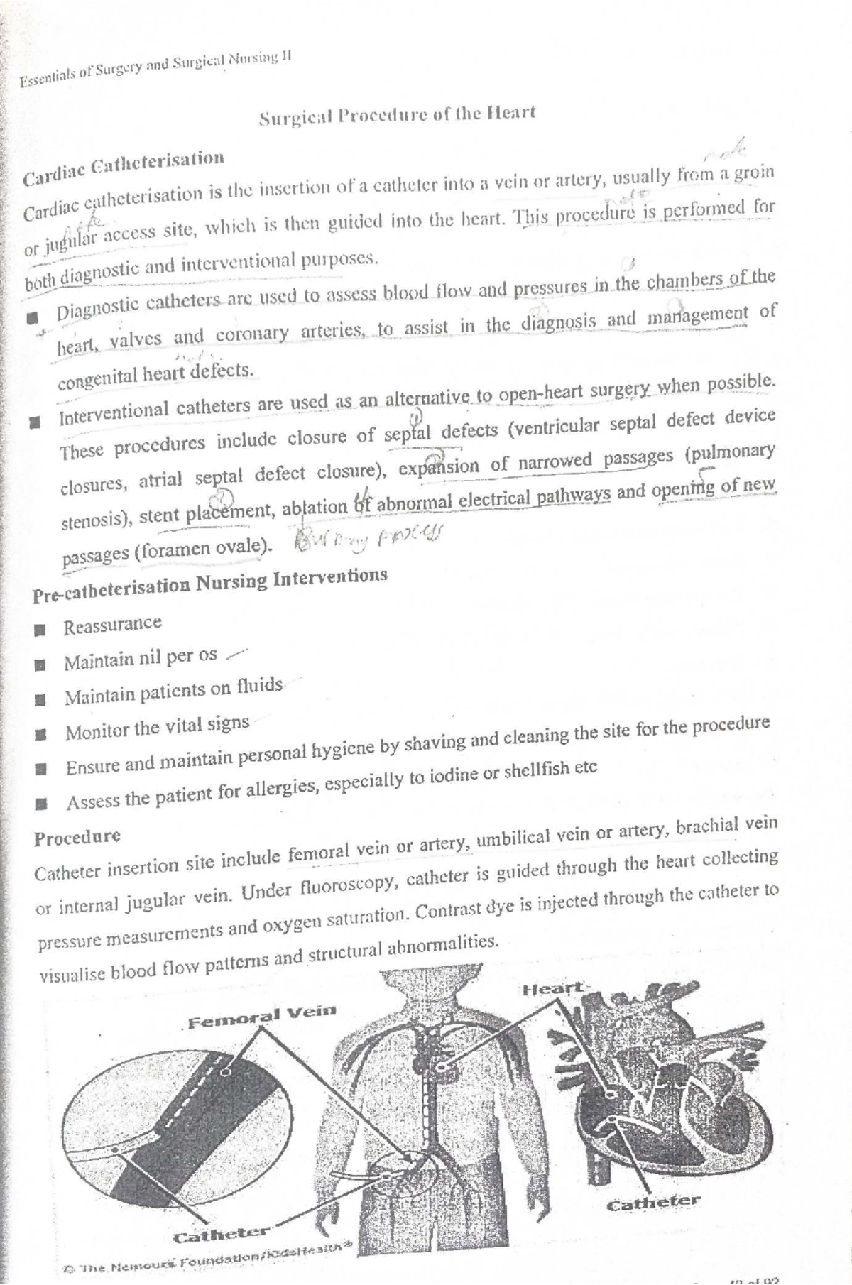 Essentials of Surgery and Surgical Nursing II: Cardiac Procedures and ...