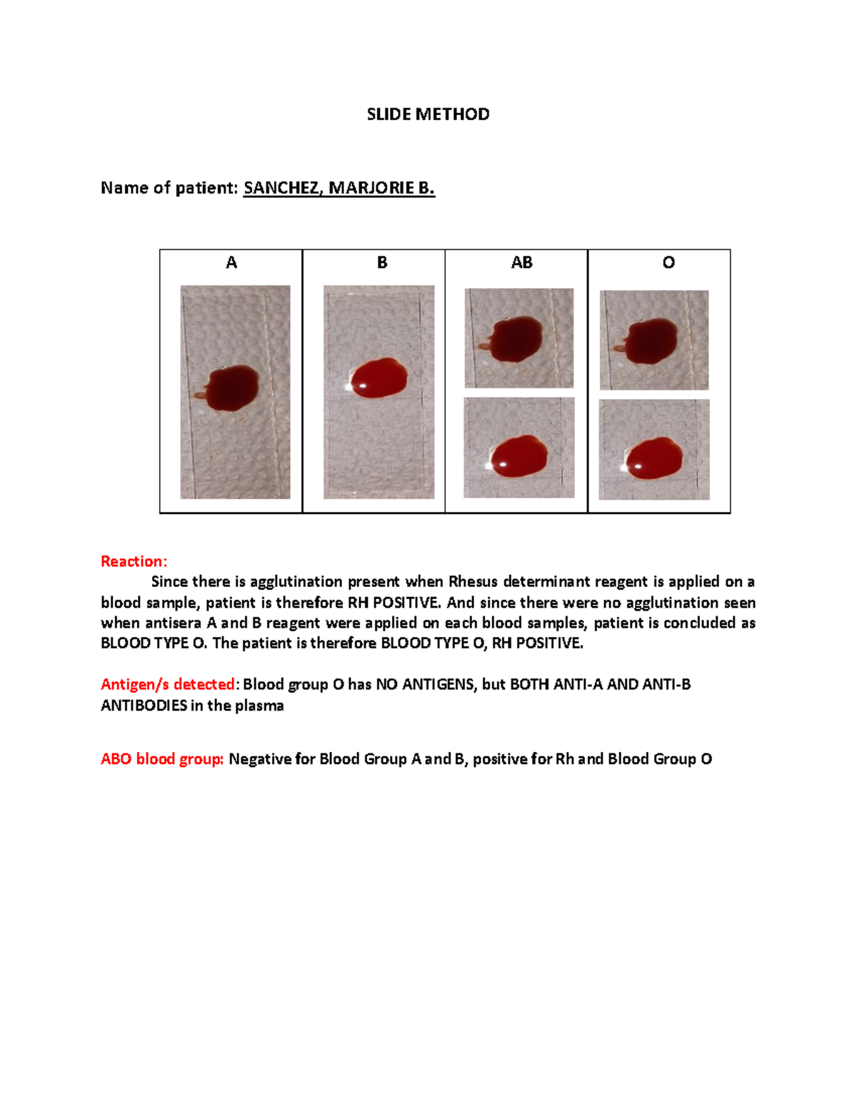 ABO Blood Typing: Slide Method Analysis for Patient Sanchez, Marjorie B ...