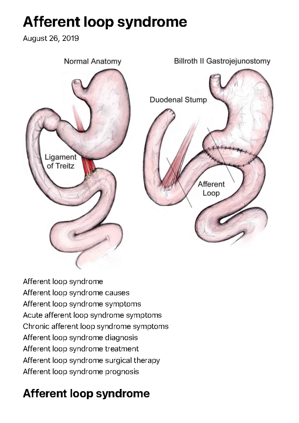 Afferent Loop Syndrome: Causes, Symptoms, Diagnosis & Treatment - Studocu