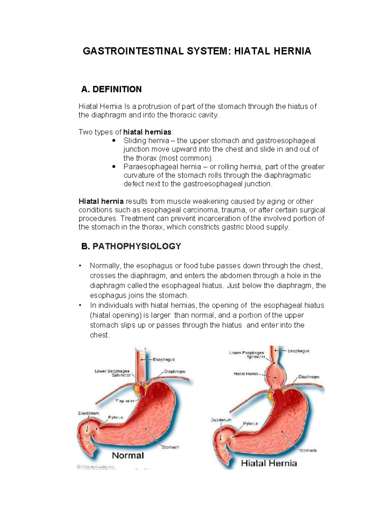 GASTRO 101: Hiatal Hernia Overview and Management Notes - Studocu