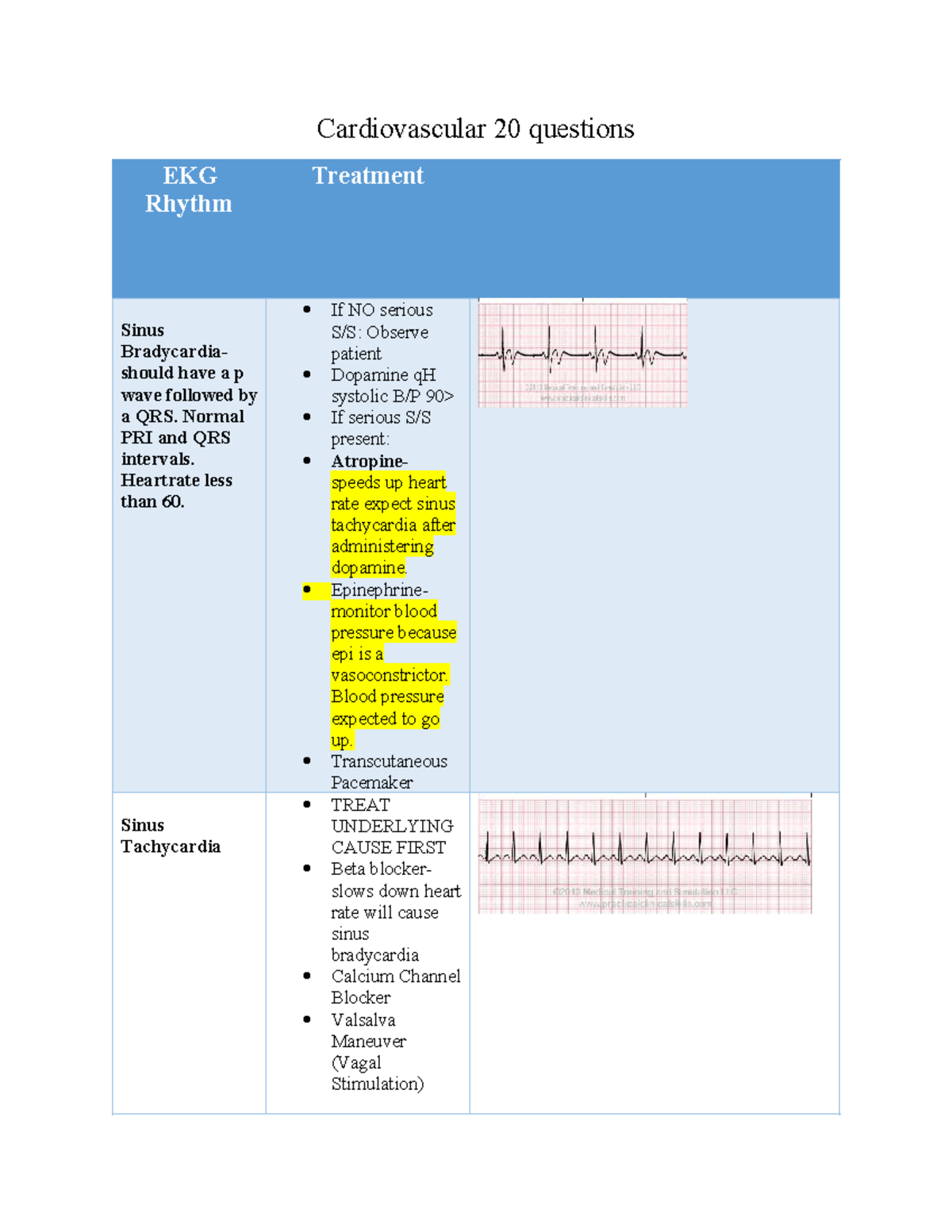 Cardiovascular EKG & Treatment Notes: Sinus Bradycardia & More - Studocu