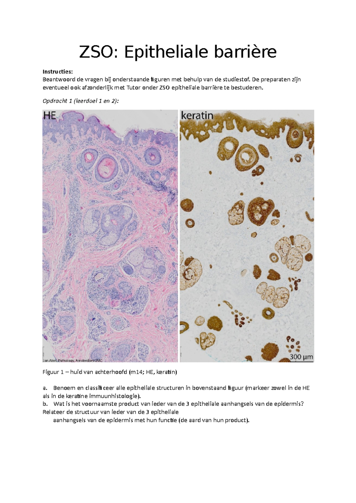 ZSO Epitheliale Barrière: Analyse en Functies van Epitheelstructuren ...