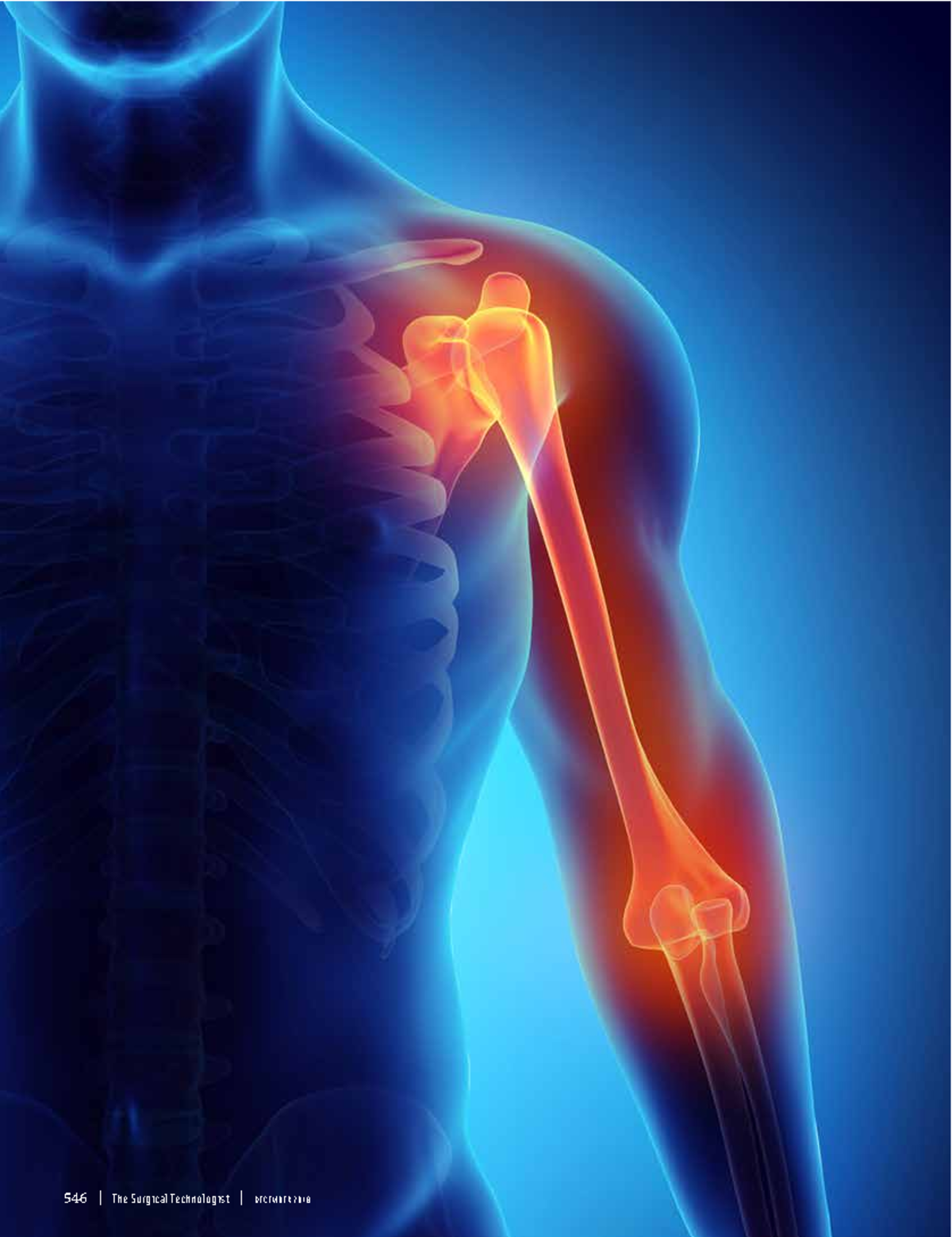 Understanding Anatomical vs. Reverse Shoulder Arthroplasty Procedures ...