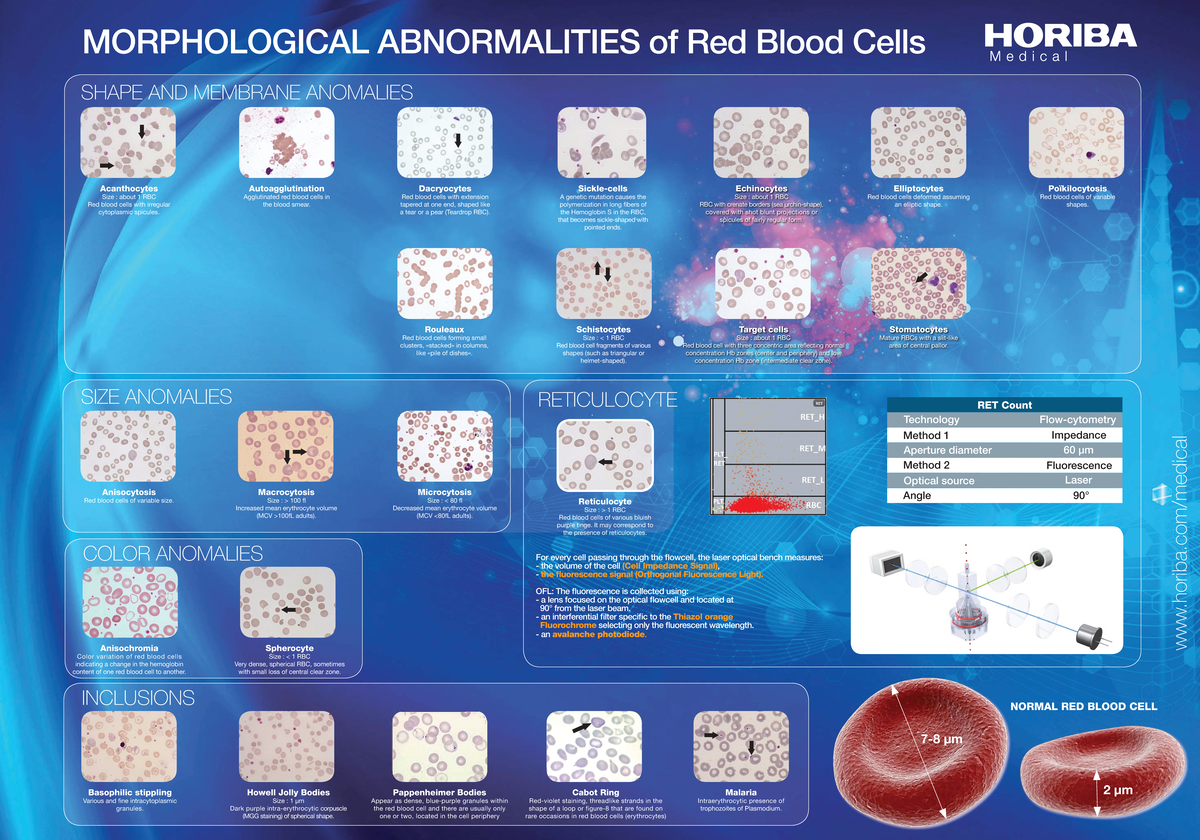 MORPHOLOGICAL ABNORMALITIES of RBCs: Hematology Poster (Horiba Med ...