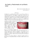 Técnicas de Acrilado y Festoneado en Prótesis Total: Proceso y ...