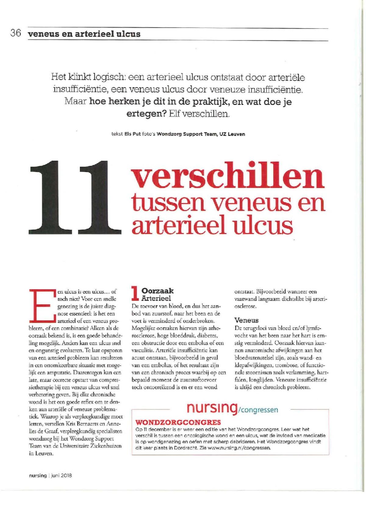 11 verschillen tussen veneus en arterieel ulcus - ####### 3 6 veneus en ...