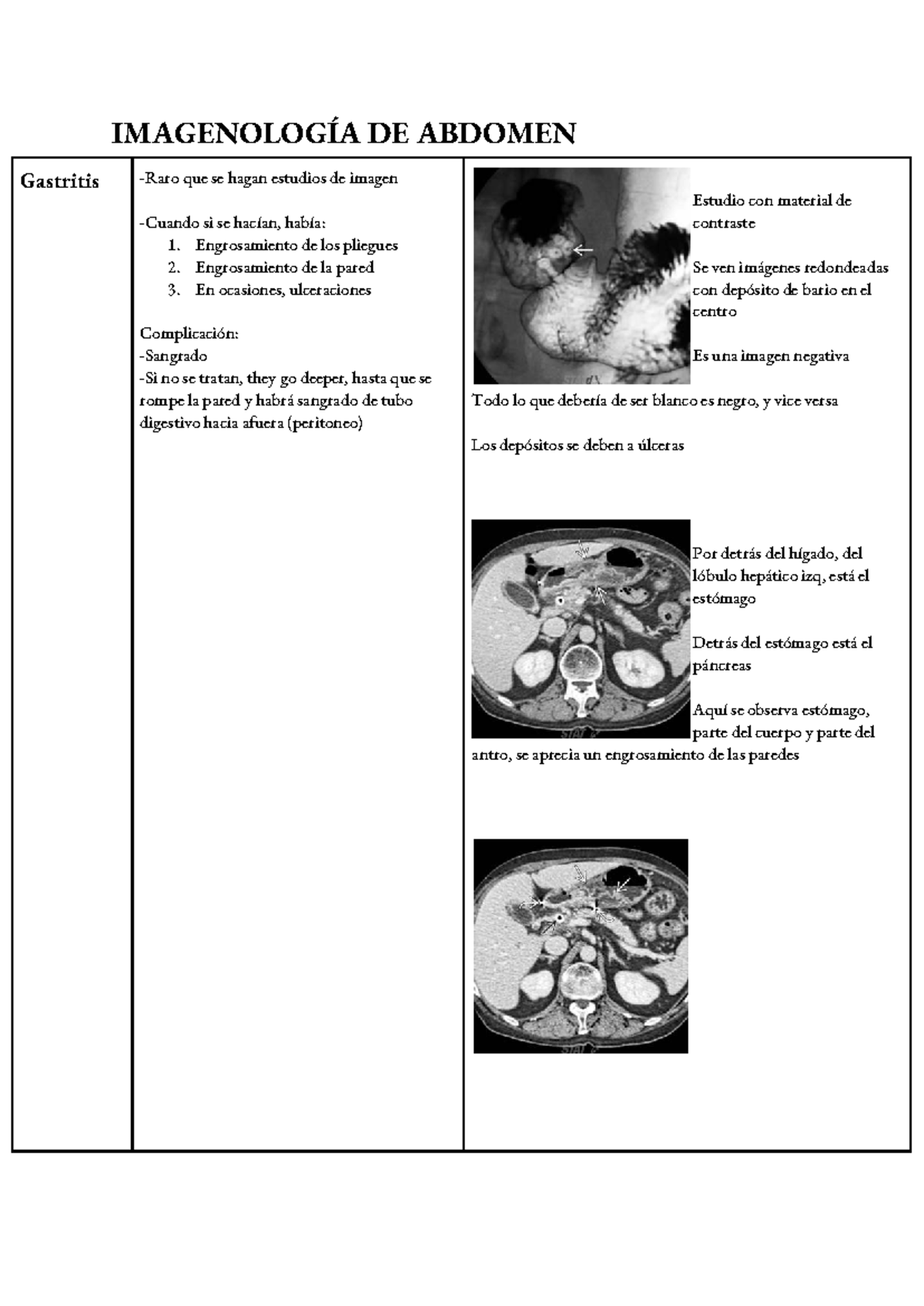 IMAGENOLOGÍA DE ABDOMEN: Estudio de Gastritis y Patologías Pediátricas ...