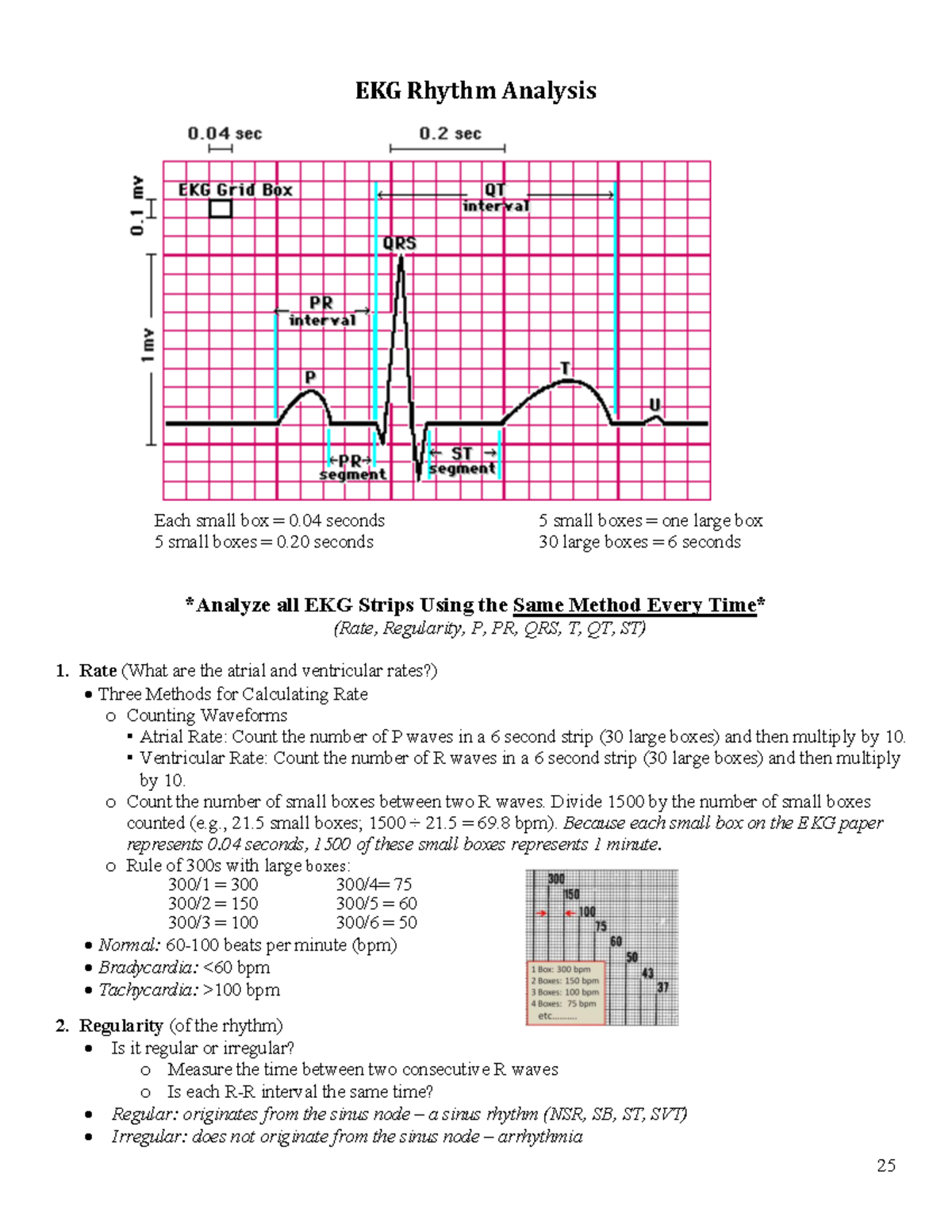EKG analysis - 25 EKG Rhythm Analysis Each small box = 0 seconds 5 ...
