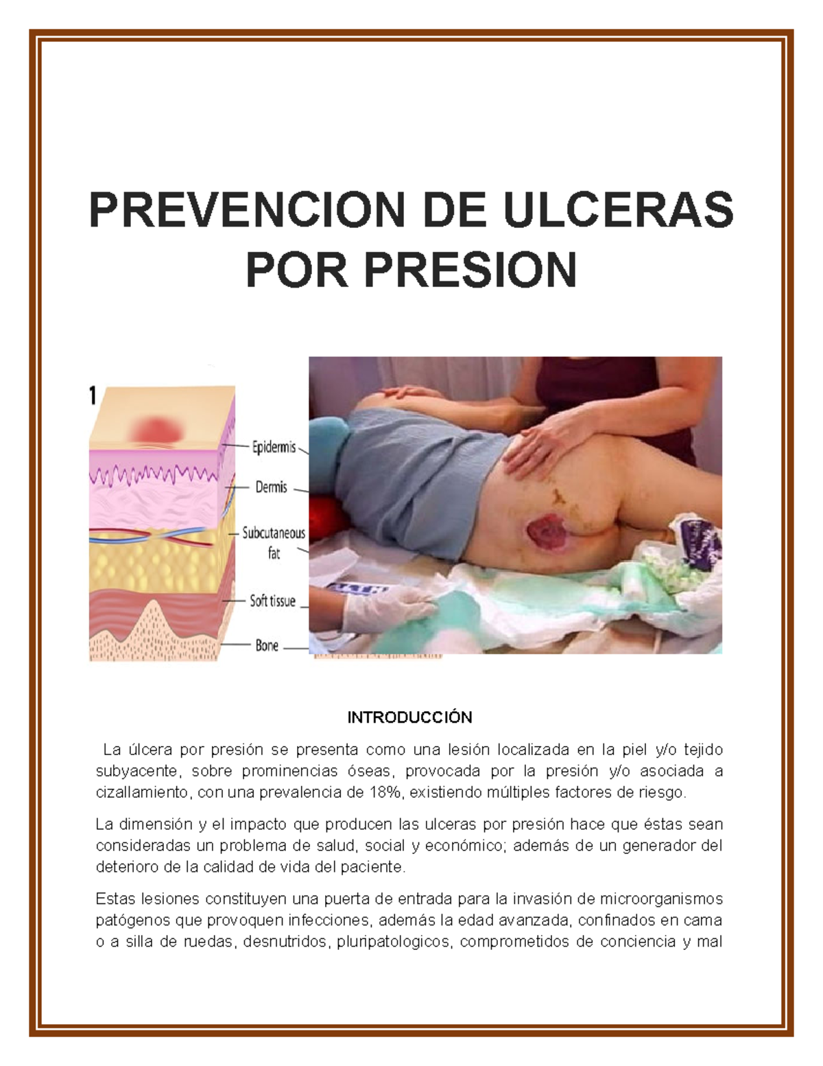 Prevención de Úlceras por Presión: Guía y Estrategias de Cuidado - Studocu