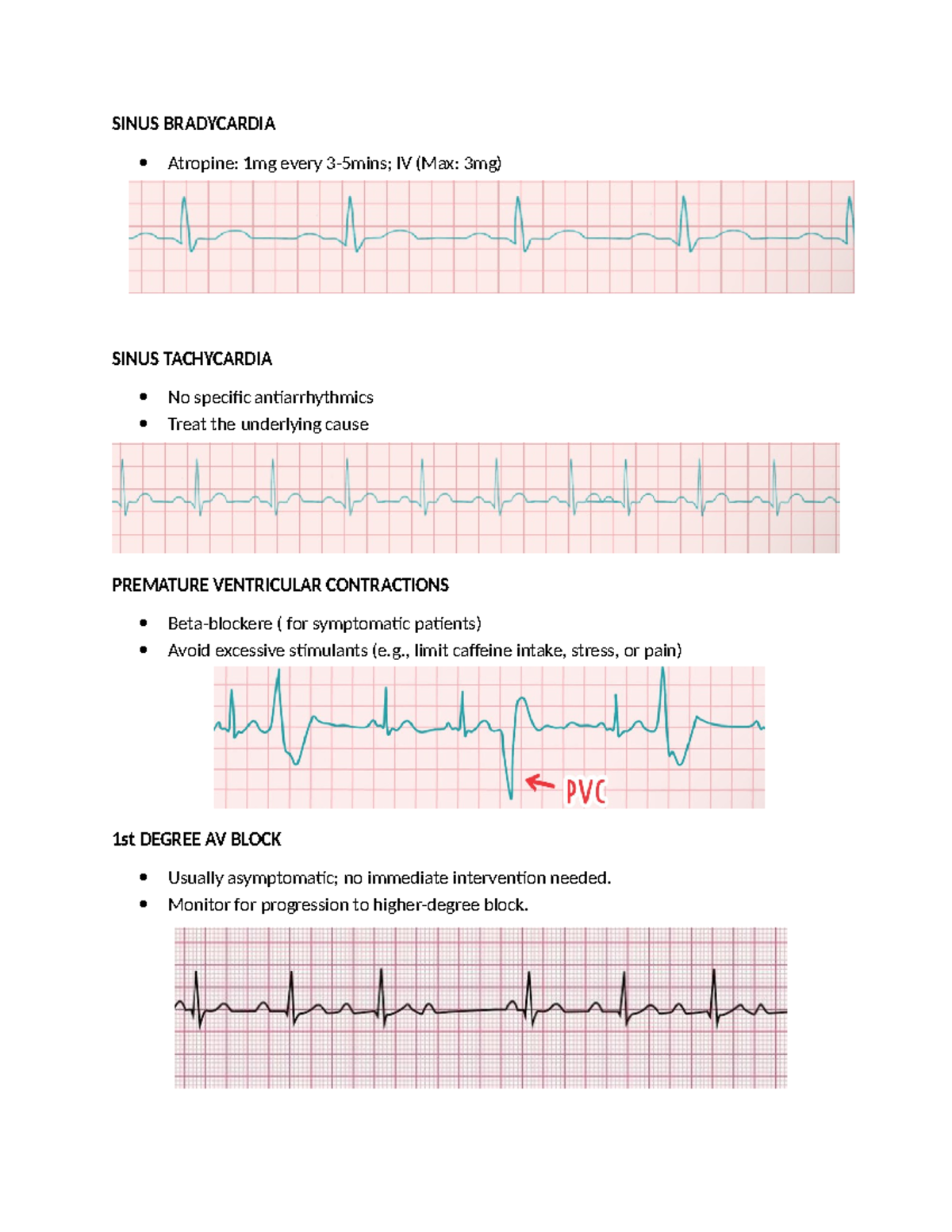 Document - CARDIAM RHTYHM - BSNursing - SINUS BRADYCARDIA Atropine: 1mg ...