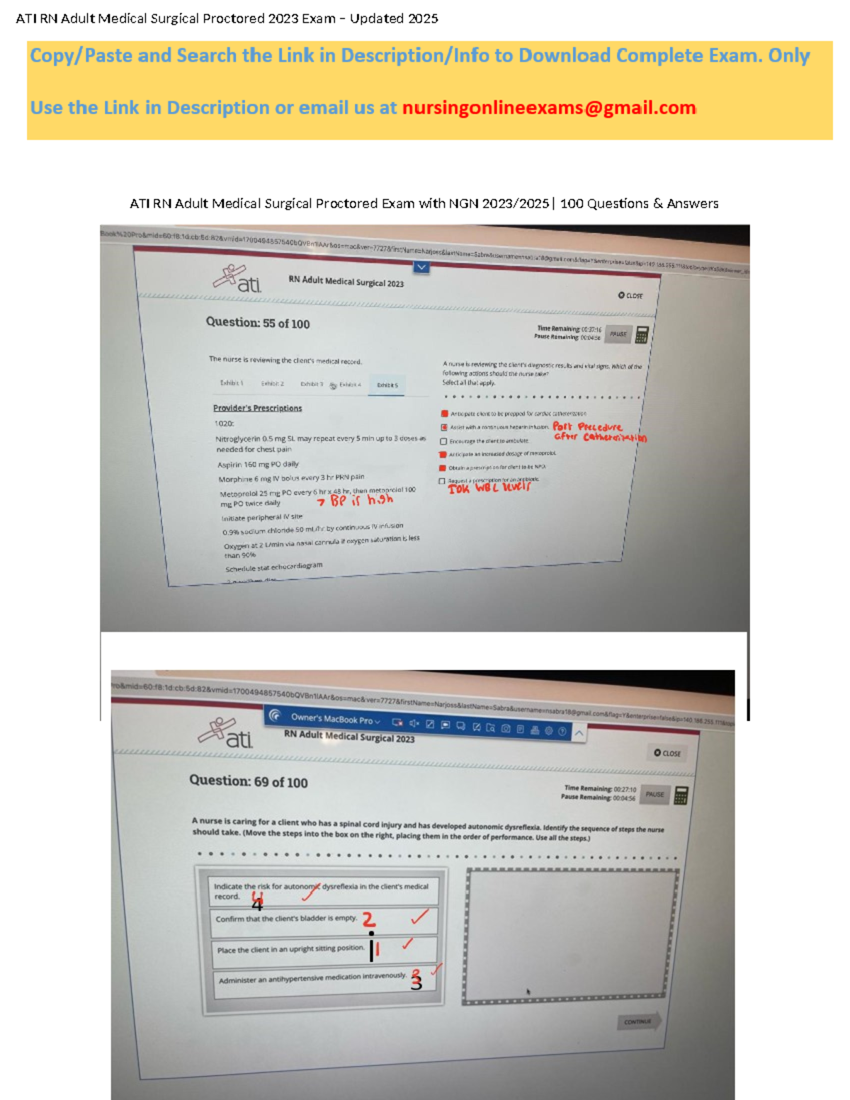 ATI RN Adult Medical Surgical Proctored 2023 Exam with NGN 100% Correct Screenshot Questions ...