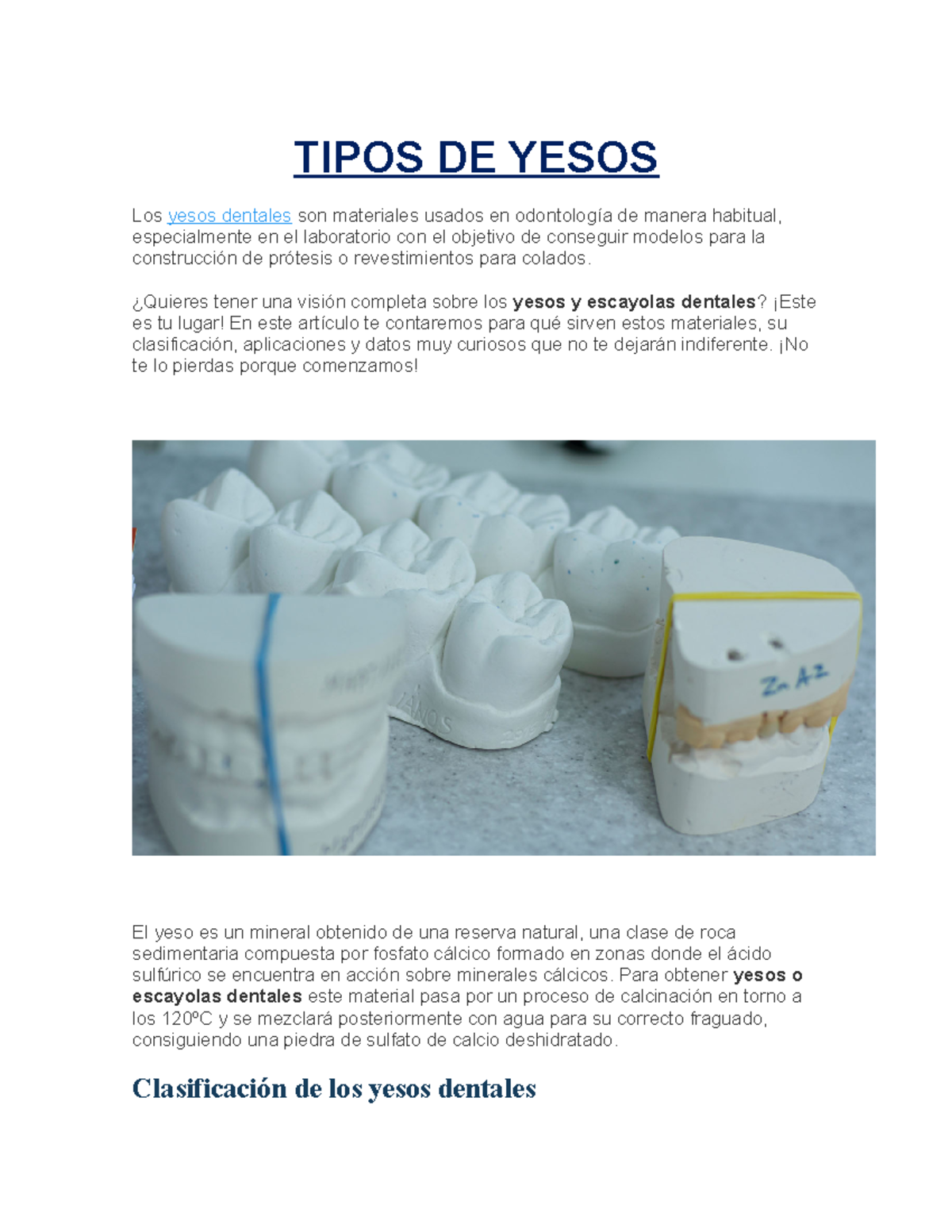 Clasificación y Aplicaciones de Yesos Dentales: Tipos y Usos - Studocu