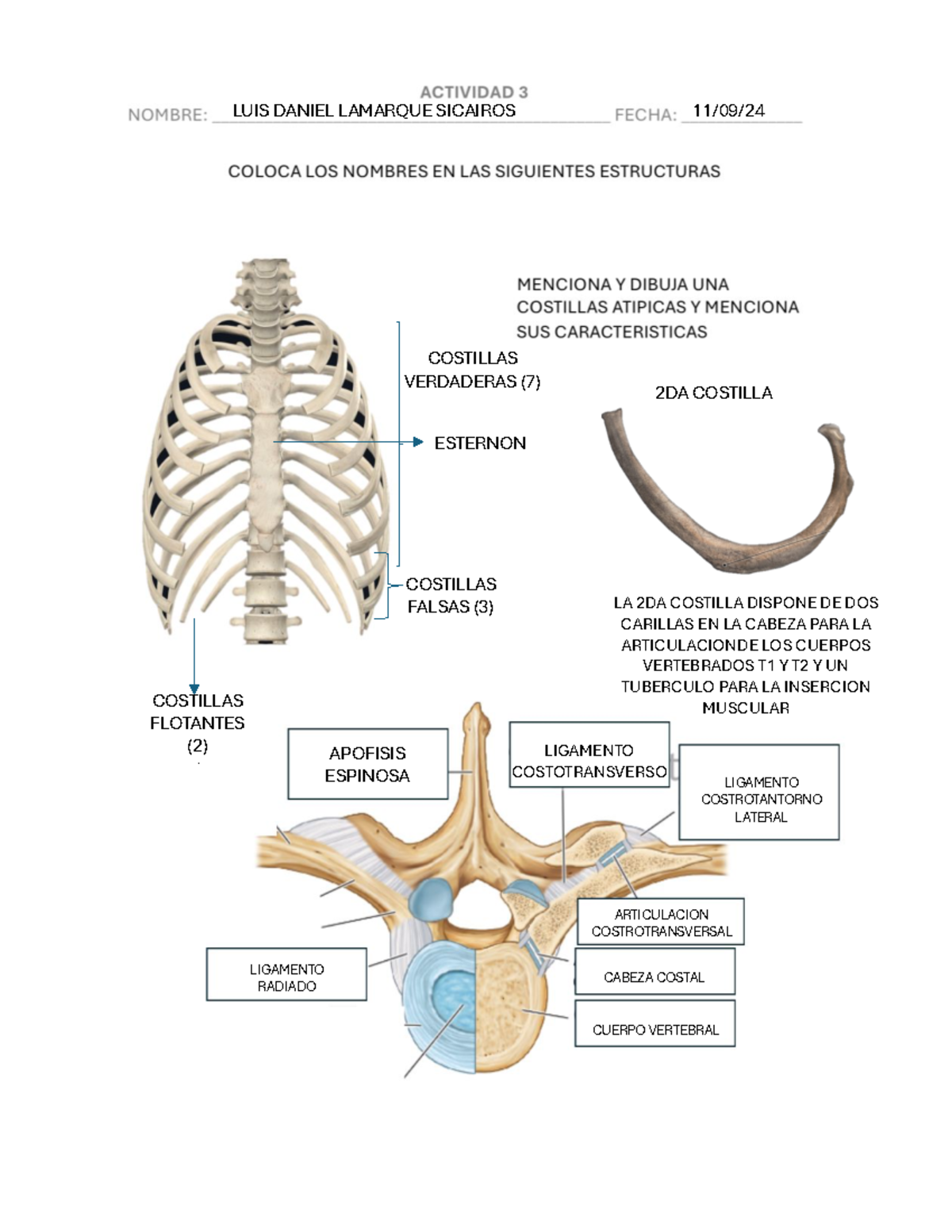 Anatomía De La Costilla