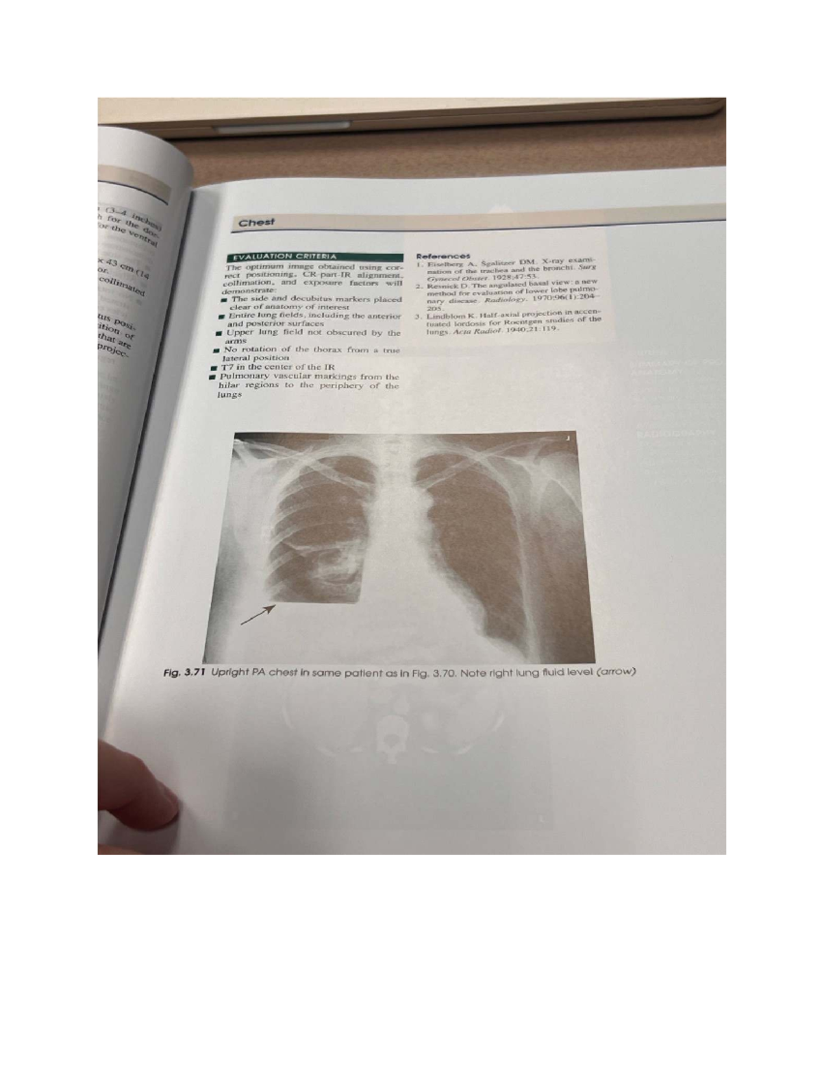Chest Evaluation Criteria for Radiographic Imaging Techniques (RAD 301 ...