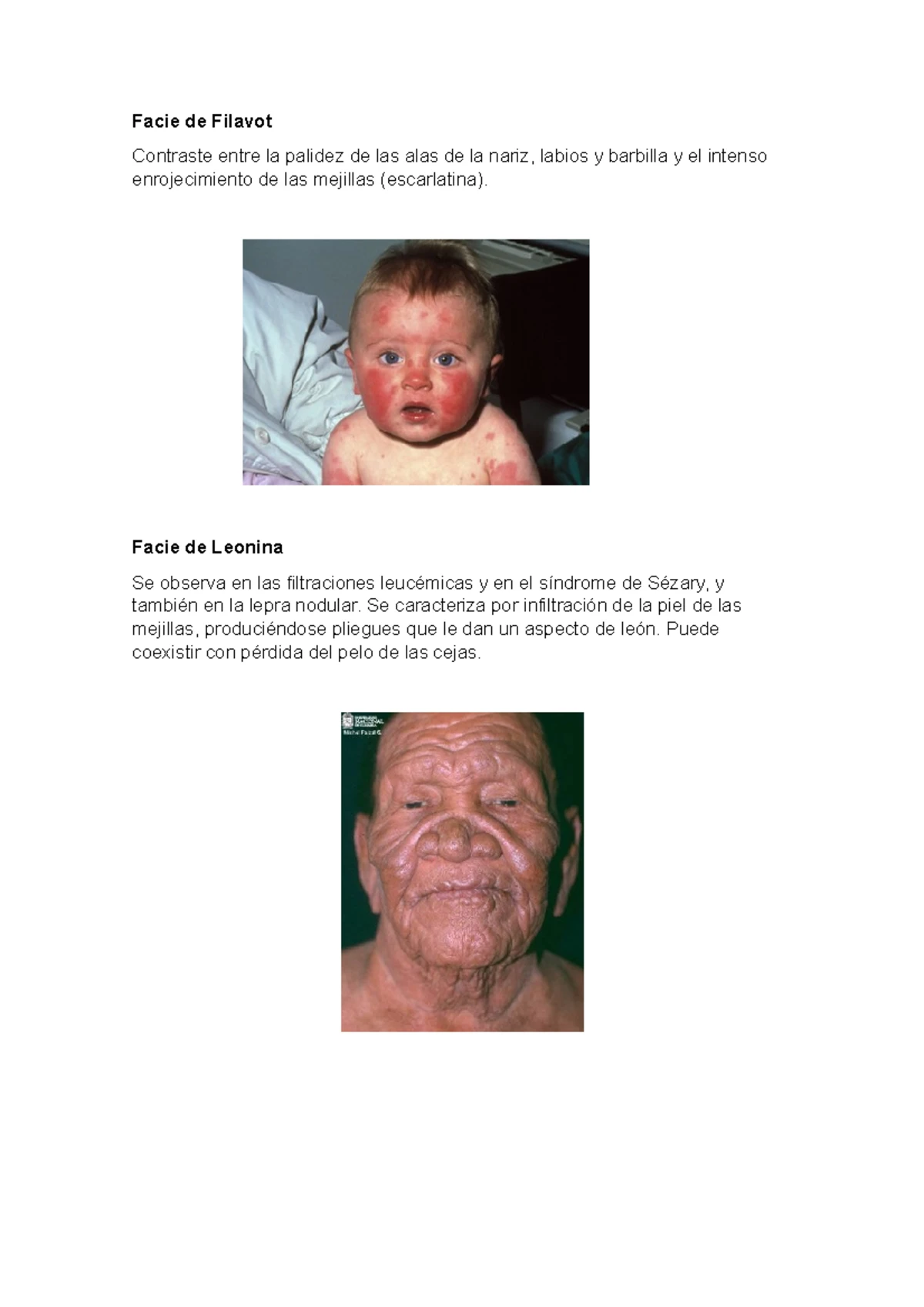 Facies de la cara, tipos de facies y sus características, propedéutica ...