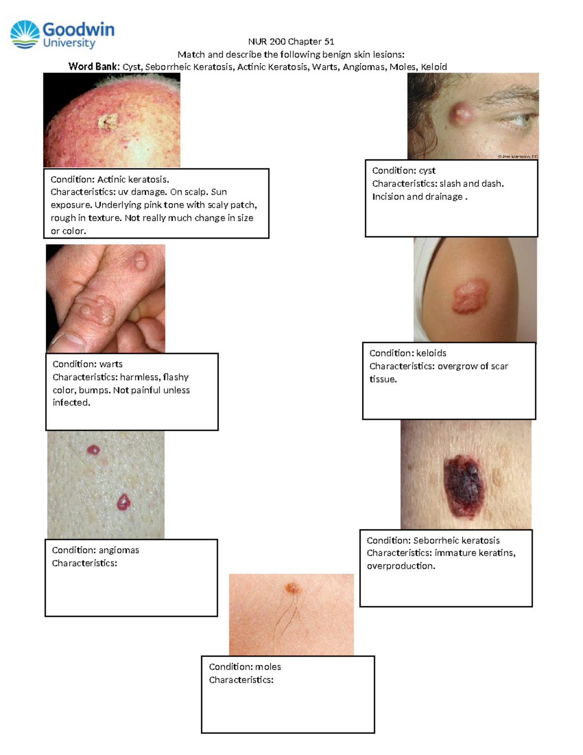 GU Types of Benign Skin Lesions - Matching-1 - Condition: moles ...
