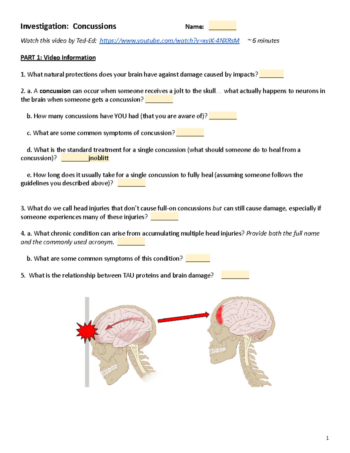 Investigation into Concussions: Understanding Impact and CTE - Studocu