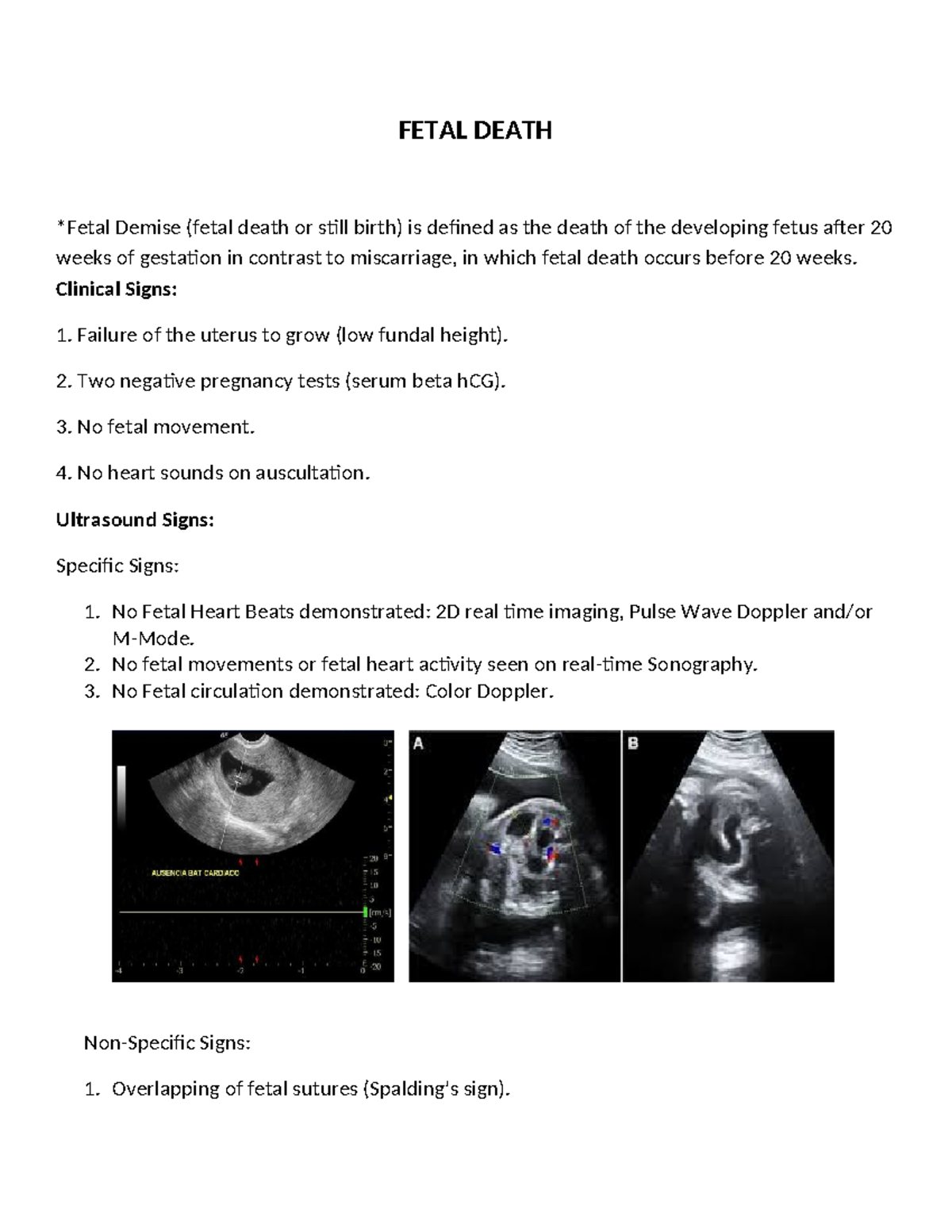 Fetal Death Diagnosis and Clinical Signs: Important Factors to Note ...