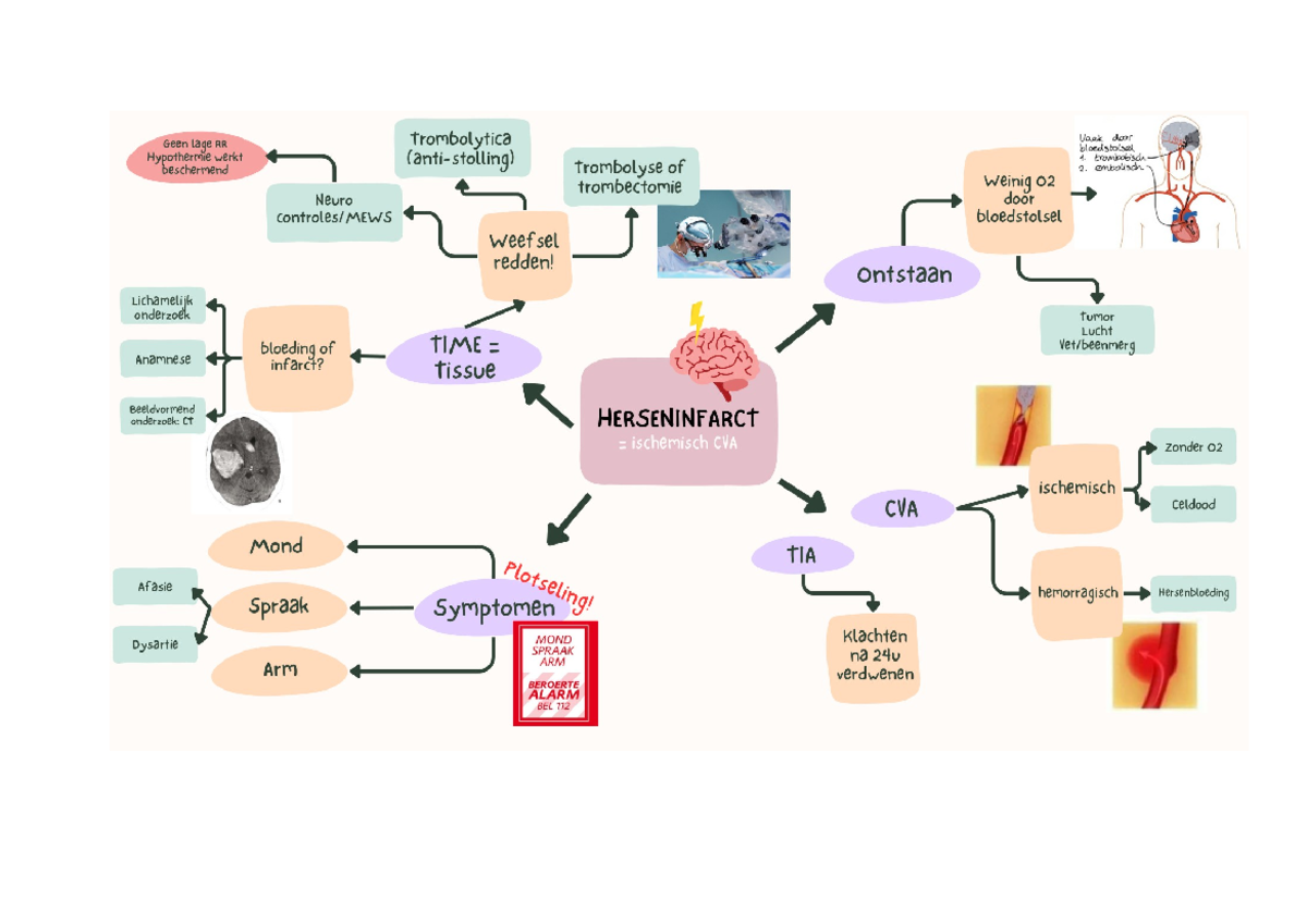 HERSENINFARCT: Behandeling en Diagnostiek van Ischemisch CVA - Studeersnel