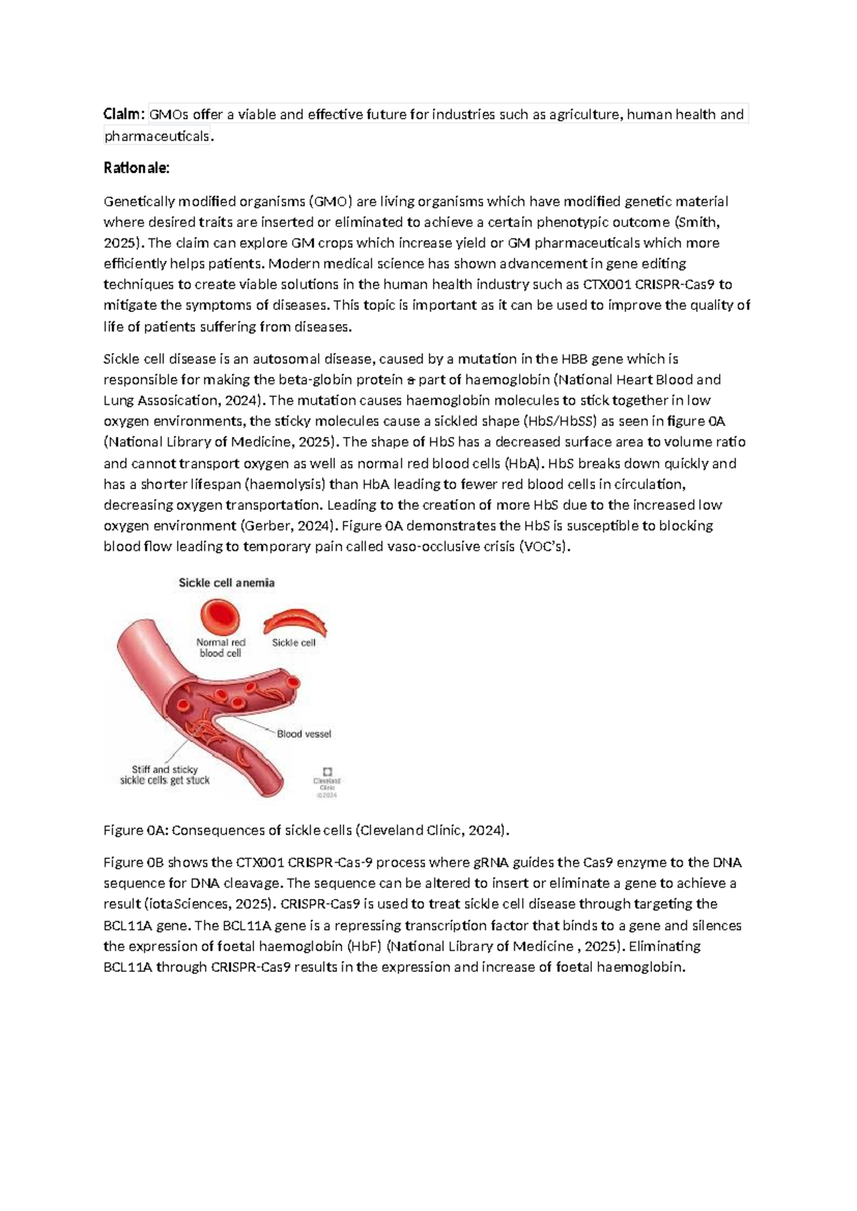 Biology IA3 2025 - The Role of CTX001 in Sickle Cell Disease Treatment ...