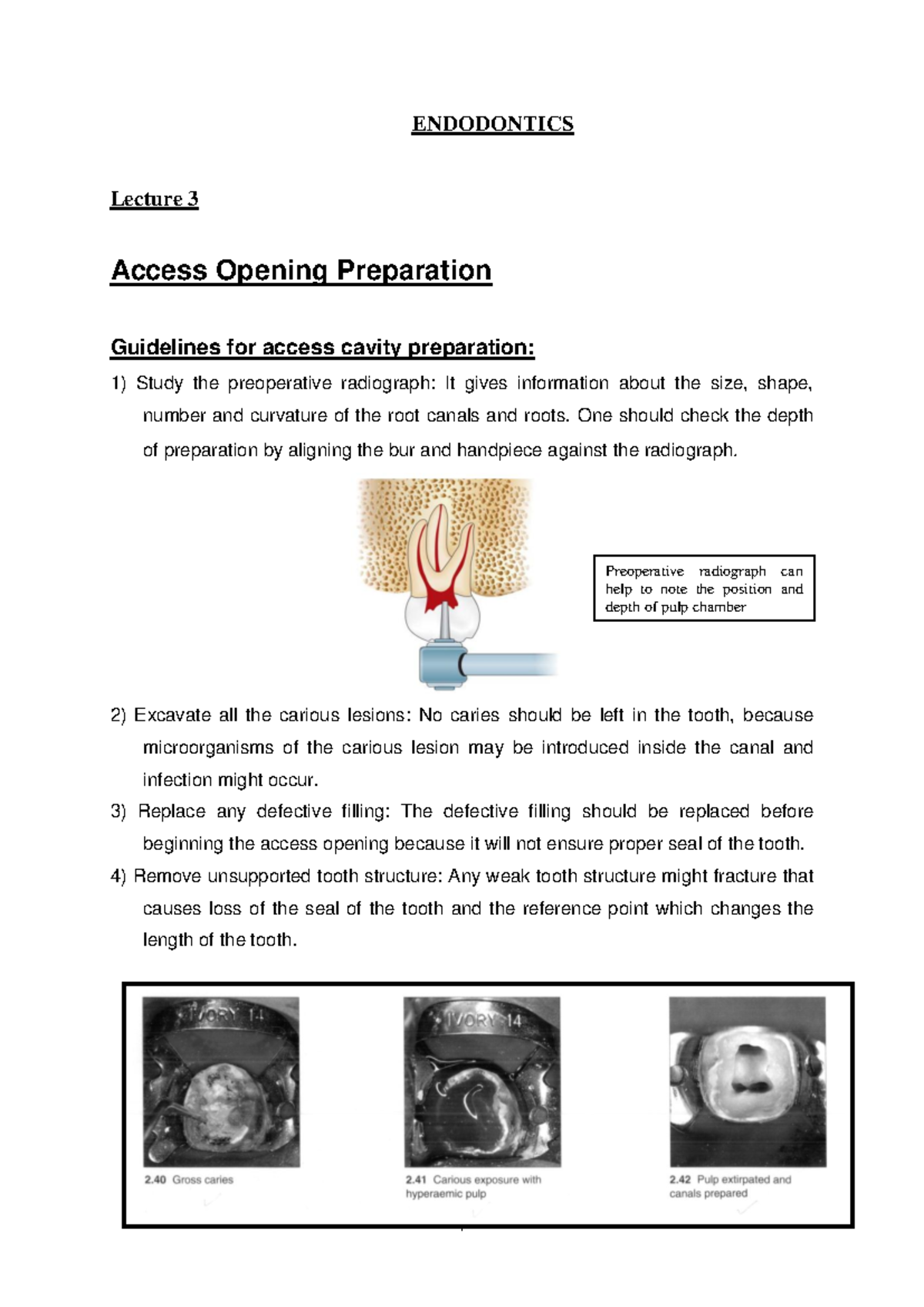 ENDO-3 - Lecture 3: Access Opening & Instruments in Endodontics - Studocu