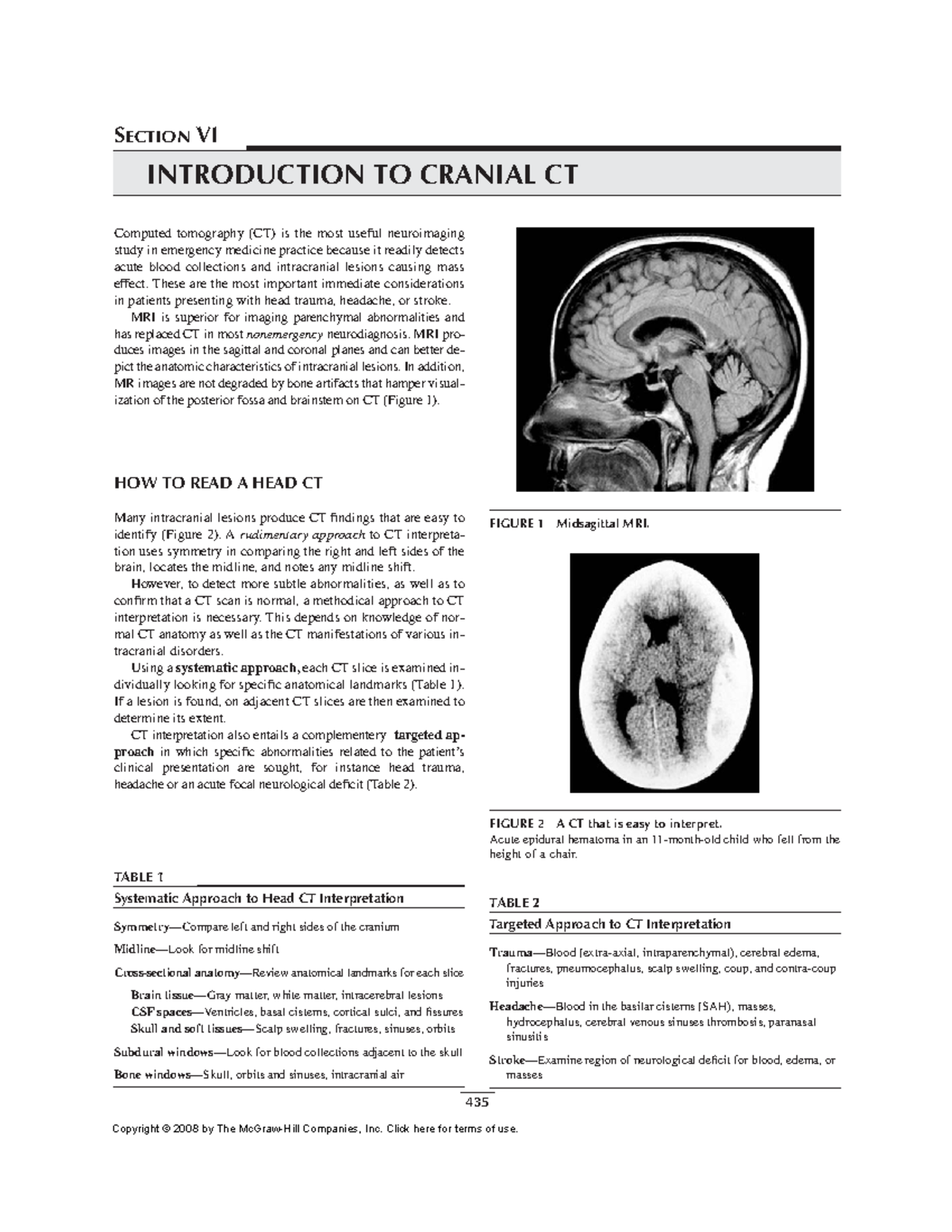 Emer Rad Case Studies CT Brain Section - SECTION VI INTRODUCTION TO ...