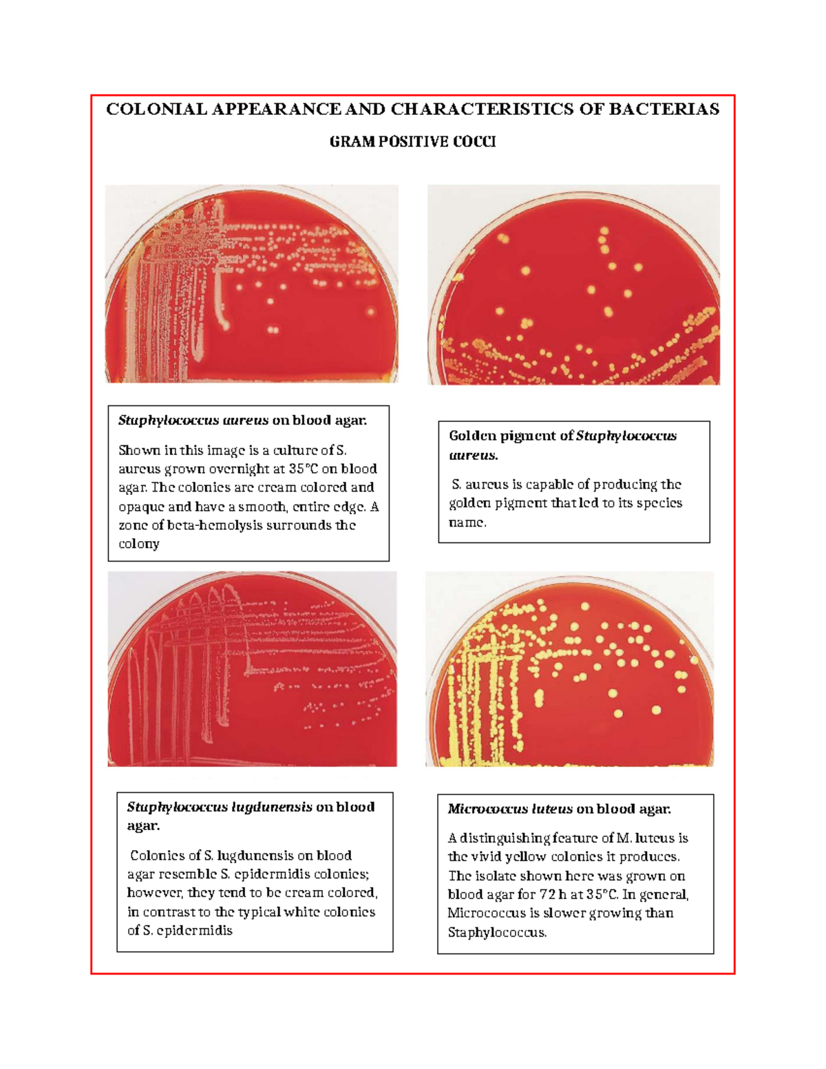 Colonial Characteristics of Bacteria: A Comprehensive Overview - Studocu