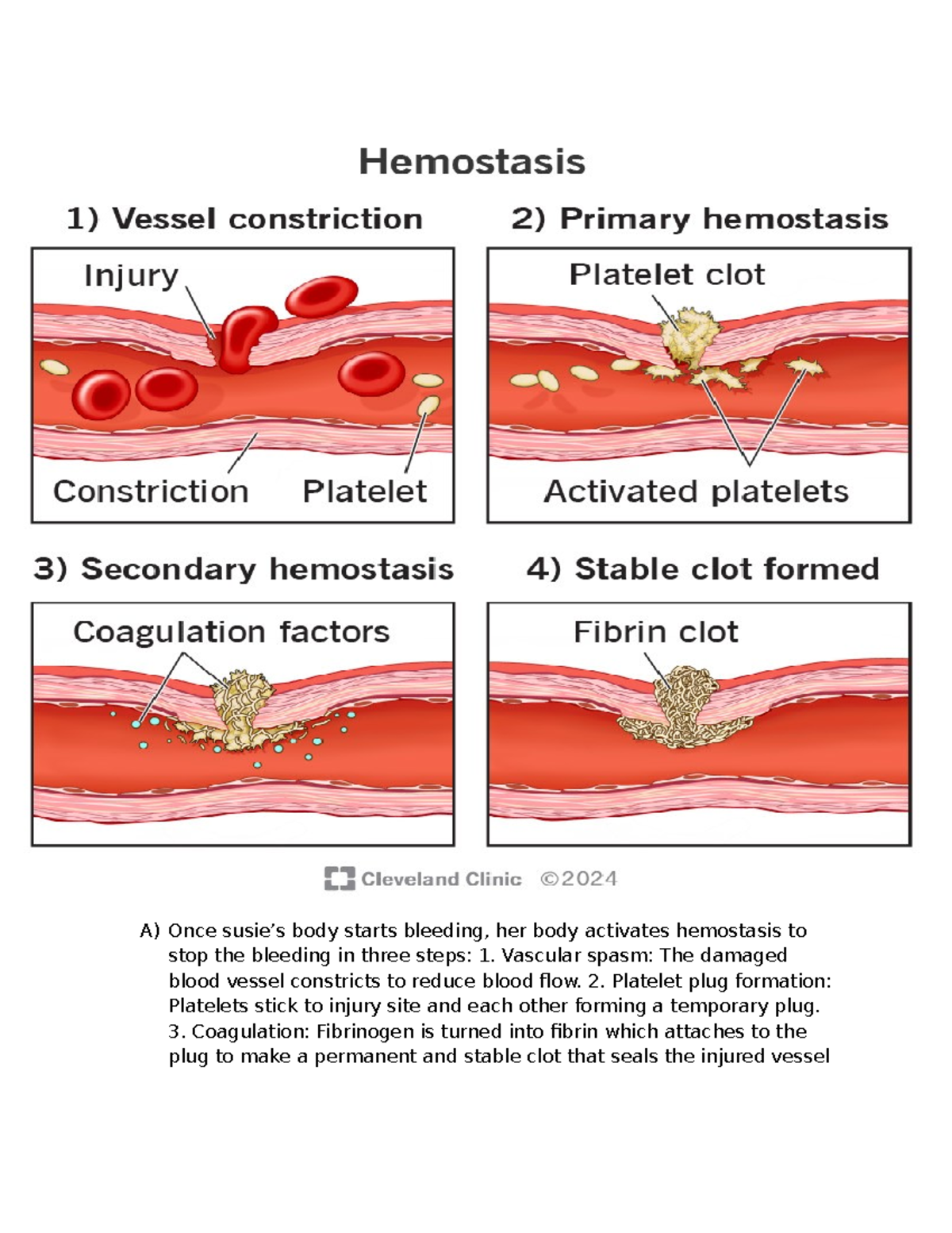 Hemostasis Process Explained: Stunning Susie - Timara - Studocu