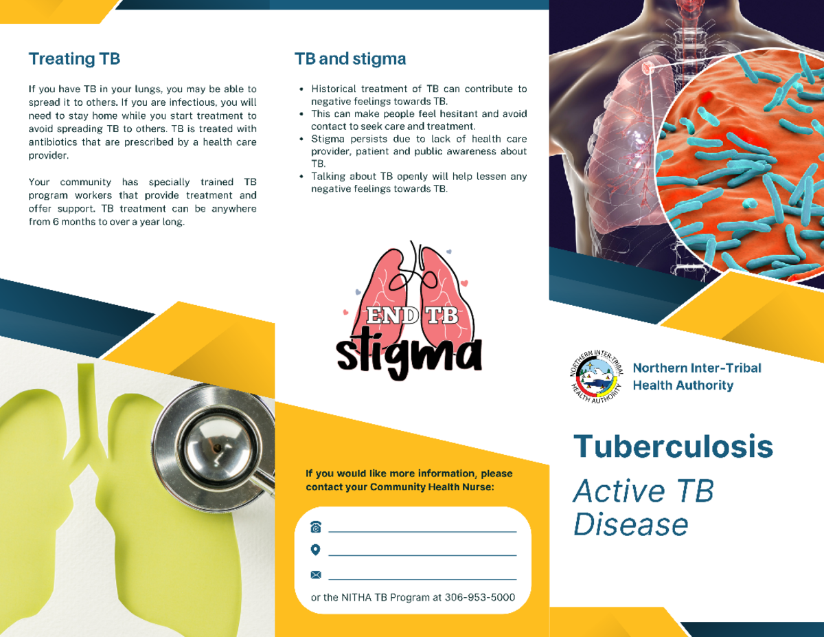 Tuberculosis Active TB Disease Trifold Brochure 2023 - Treating TB TB ...