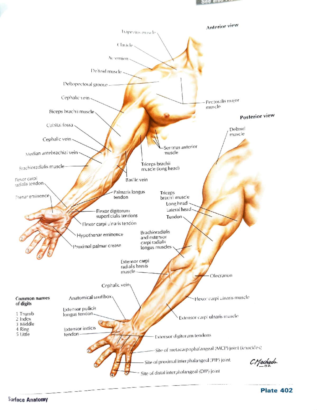 Diagram for anatomy - Flexor carpi radialis tendon. Median antebrachial ...