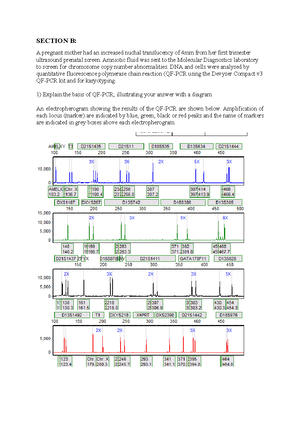 Molecular Techniques in Genetics: QF PCR, OLA, and ARMS Tests Analysis ...