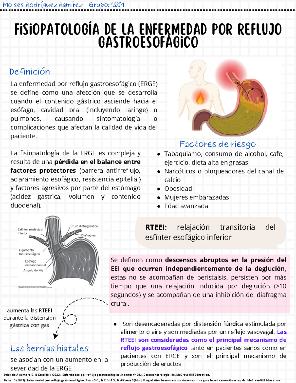 Fisiopatología del Reflujo Gastroesofágico: Definición y Mecanismos ...