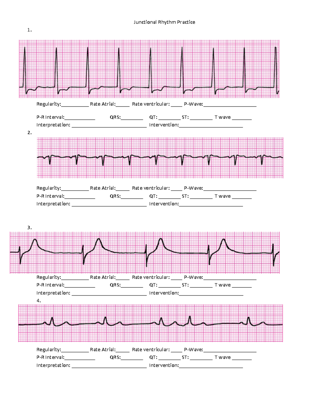 Junctional Practice - EKG - Junctional Rhythm Practice 1. Regularity ...