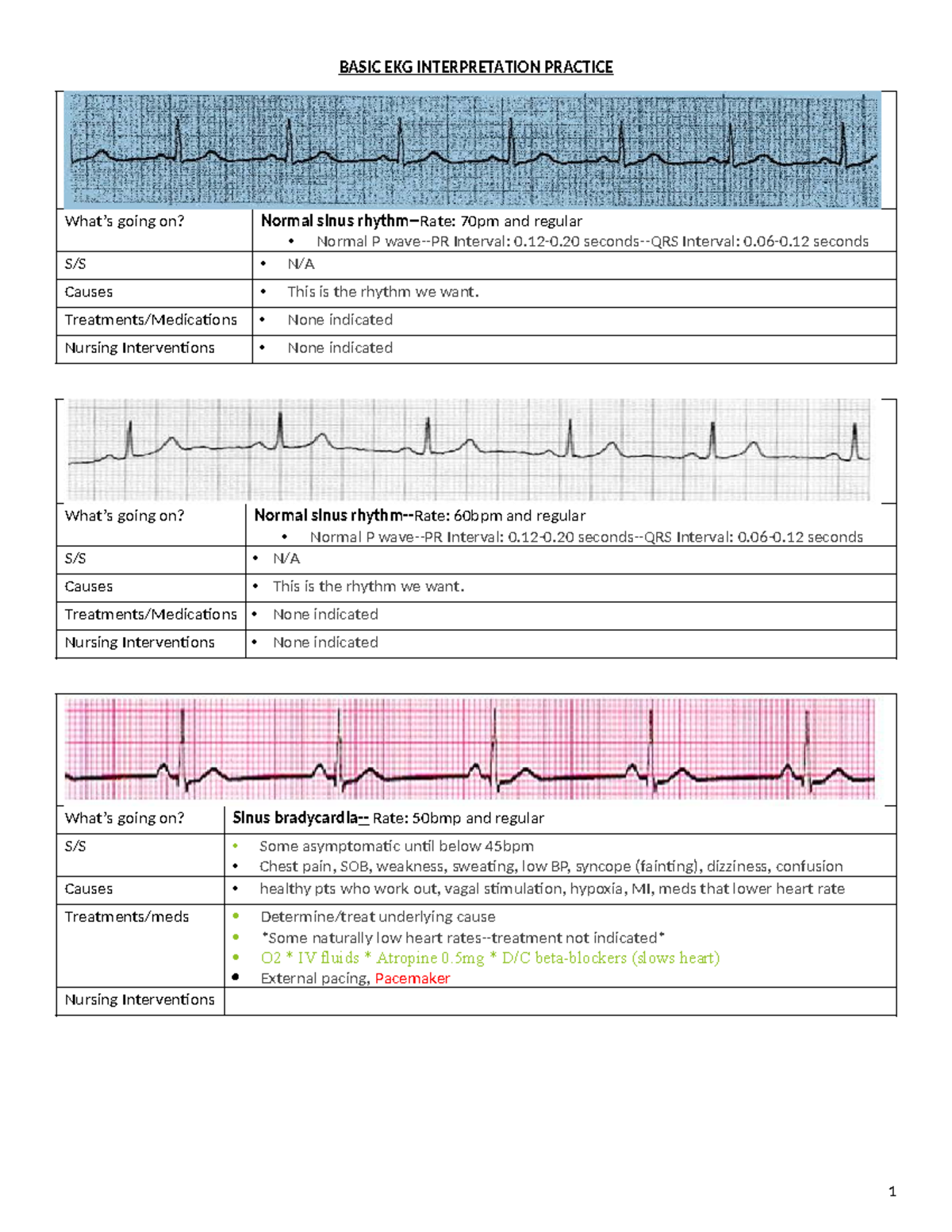 BASIC EKG INTERPRETATION PRACTICE: Key Insights and Nursing ...