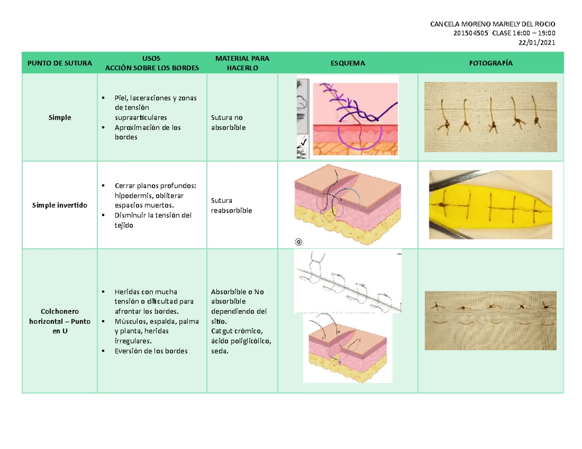 Suturas X y Z: Técnica y Tiempo de Aplicación en Urgencias - Studocu