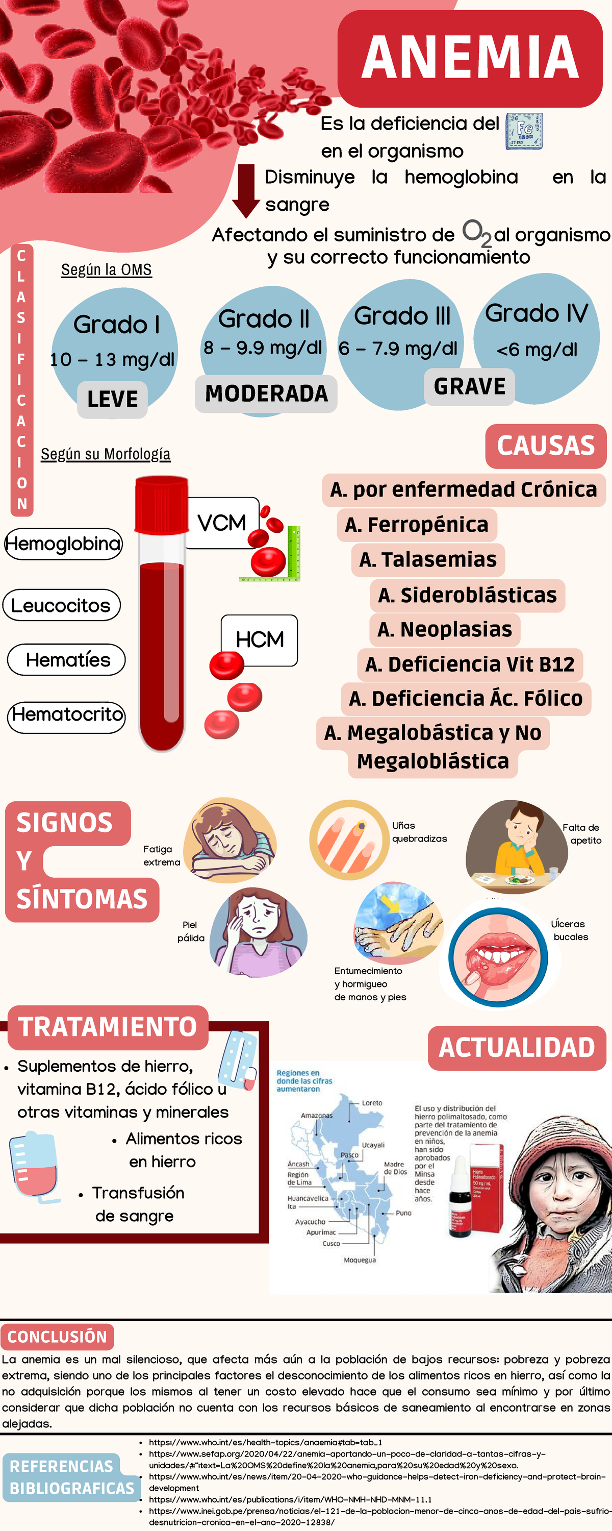 Infografía Completa sobre Anemia y su Clasificación según la OMS - Studocu