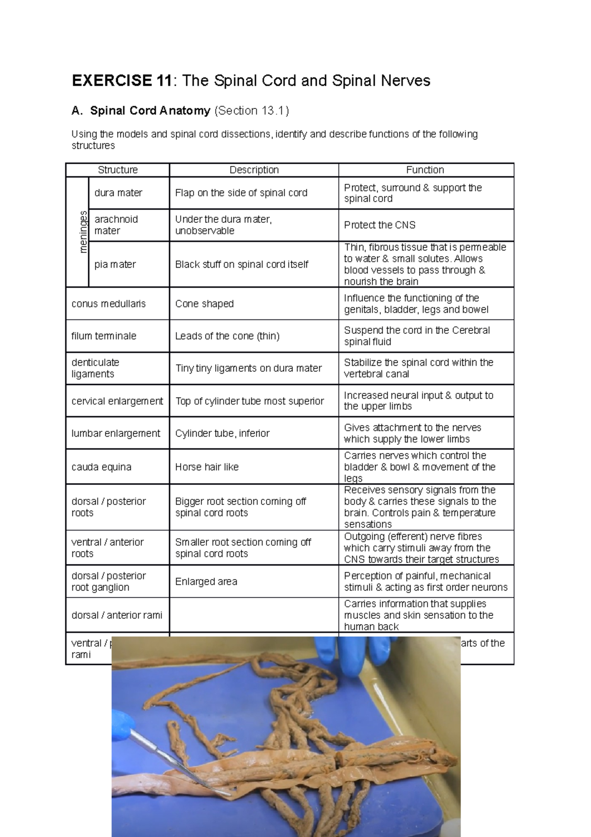 UNIT 3 LAB Notes - EXERCISE 11 : The Spinal Cord and Spinal Nerves A ...