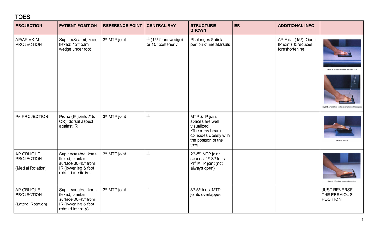 Summary of Projections for Toes, Sesamoids, Calcaneus, Ankle, Knee ...