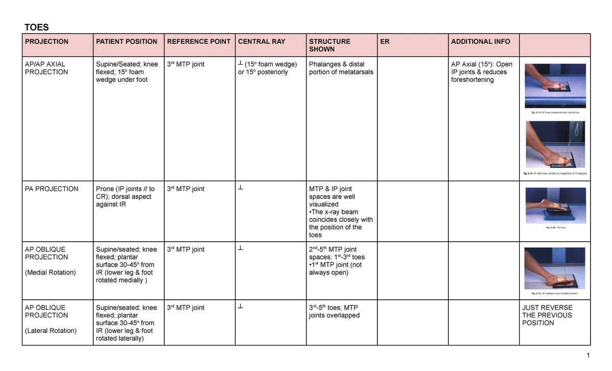 Clavicle Positioning Guide: AP and Axial Projections Medical Notes ...