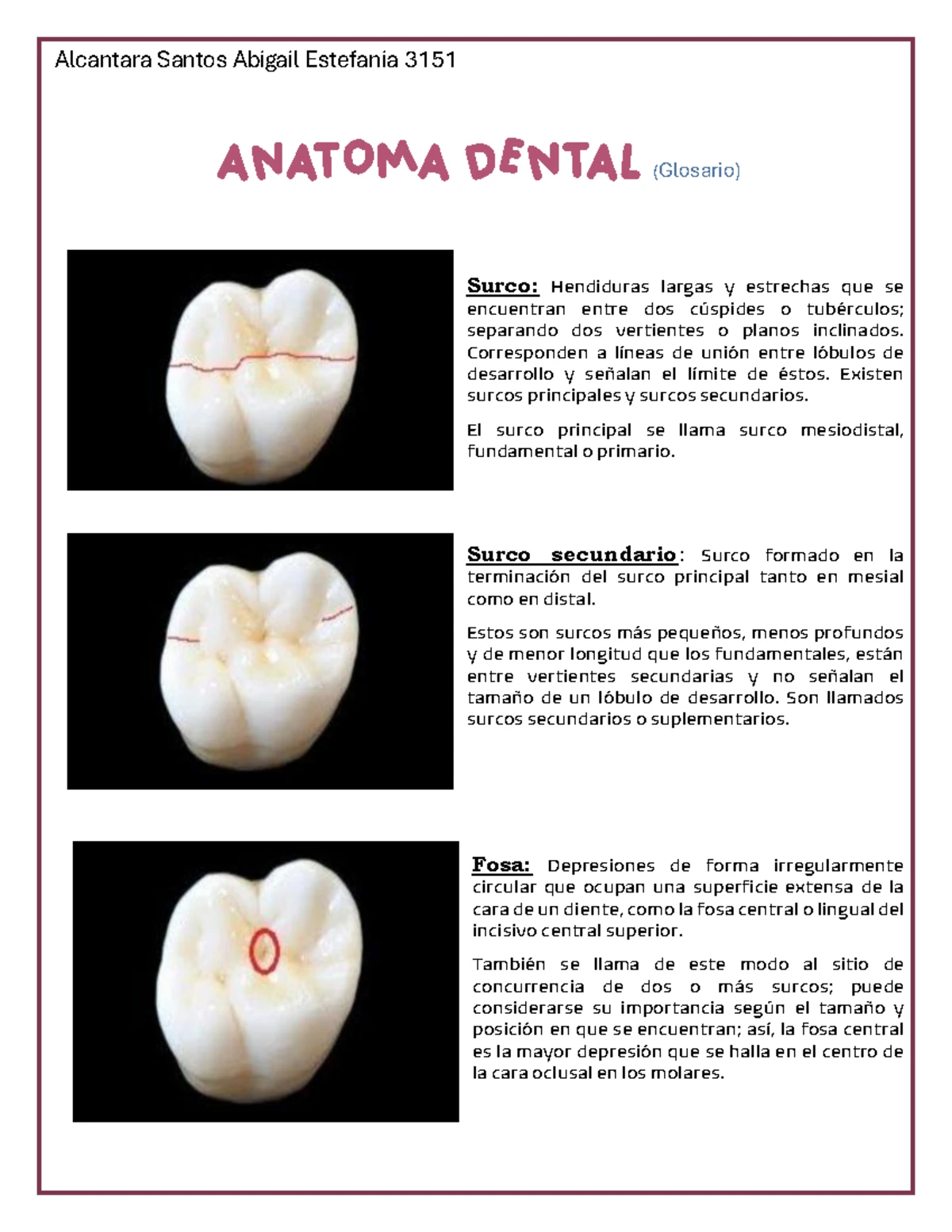 Índice PMA: Guía para Diagnóstico de Gingivitis en Odontología - Studocu