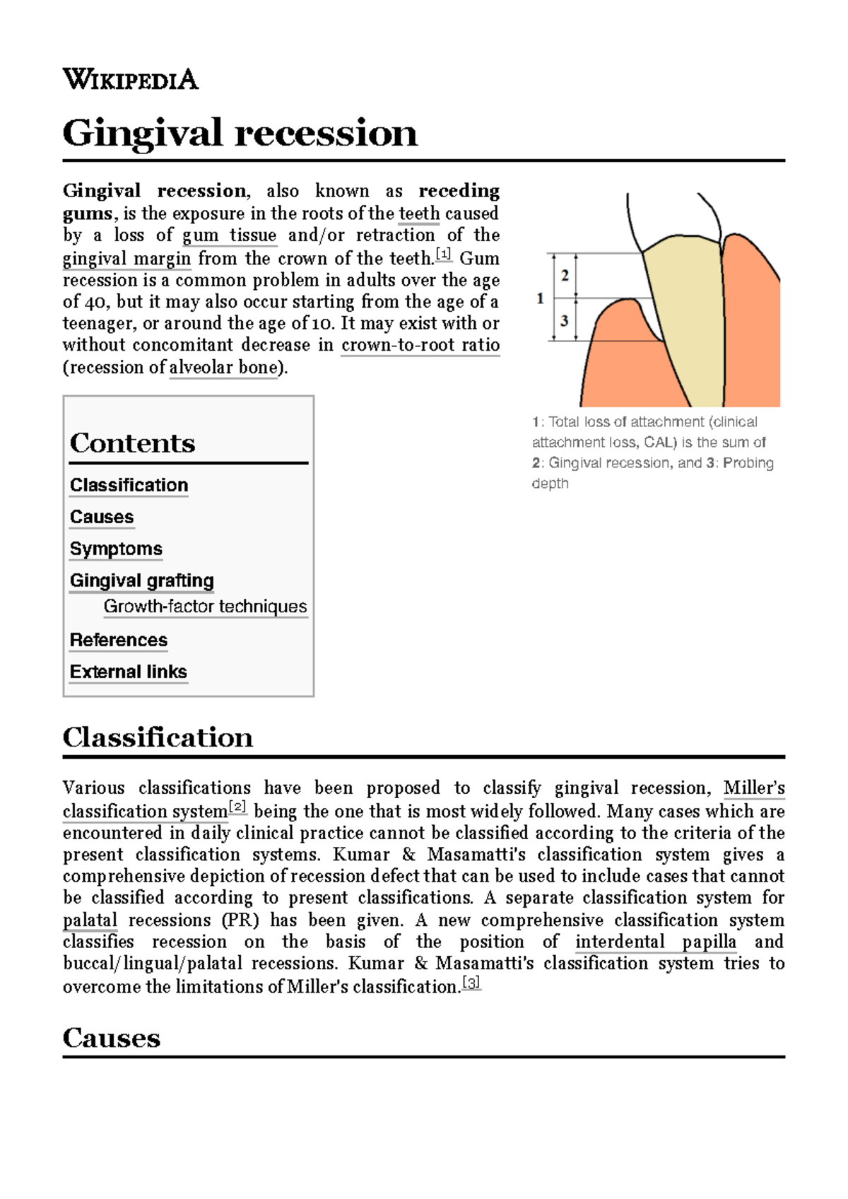 Gingival Recession Overview - Key Causes & Treatment Strategies - Studocu