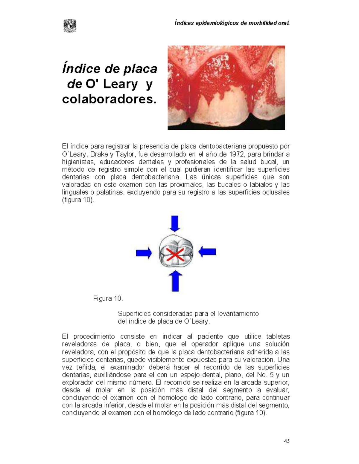Índice de Placa Dentobacteriana: Estudio Epidemiológico y Metodología ...