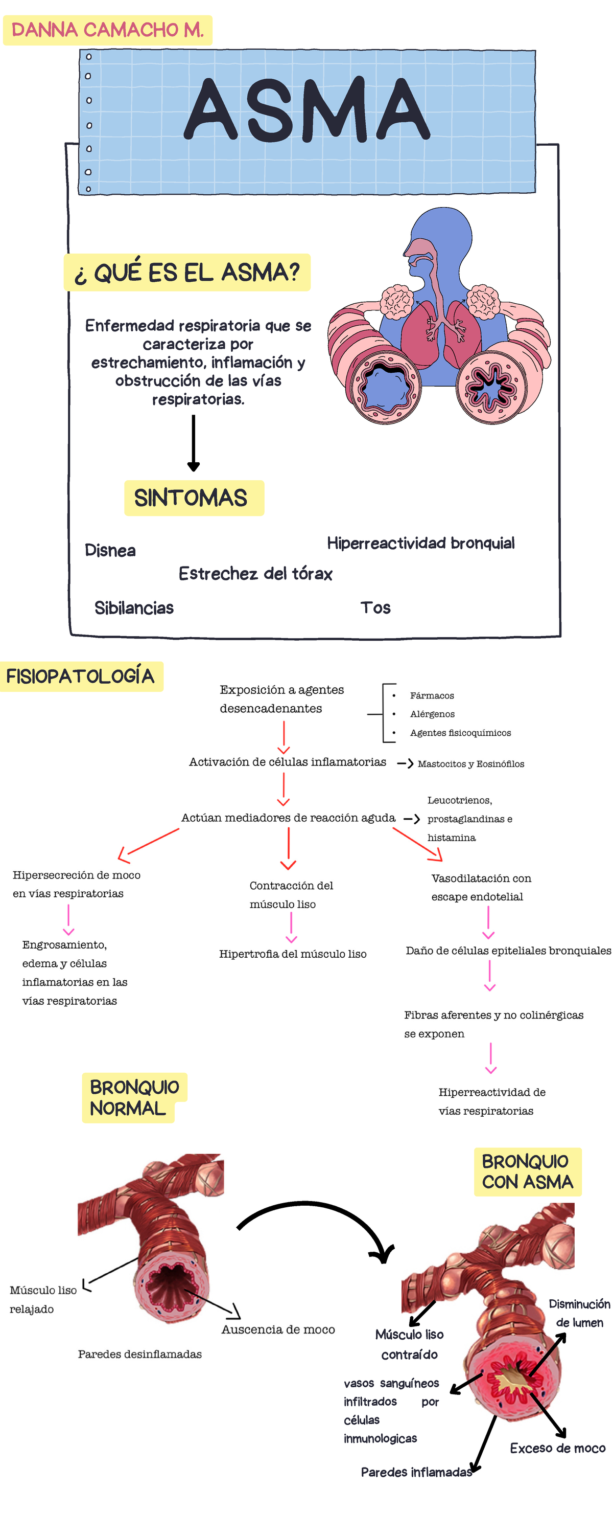 Infografía de asma - infografía de asma - ####### Enfermedad ...