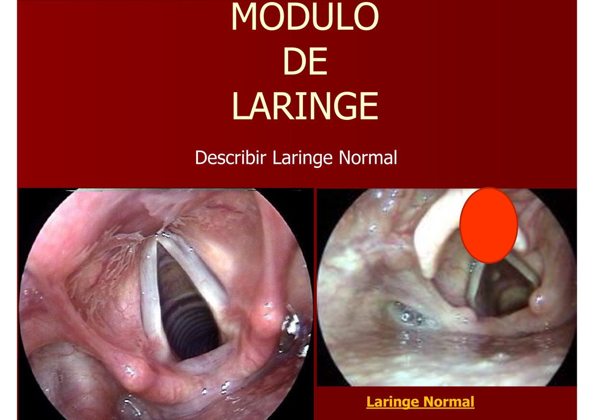 Modulo Laringe PR 18pptx 202502281437 04751 - MÓDULO DE LARINGE Laringe ...