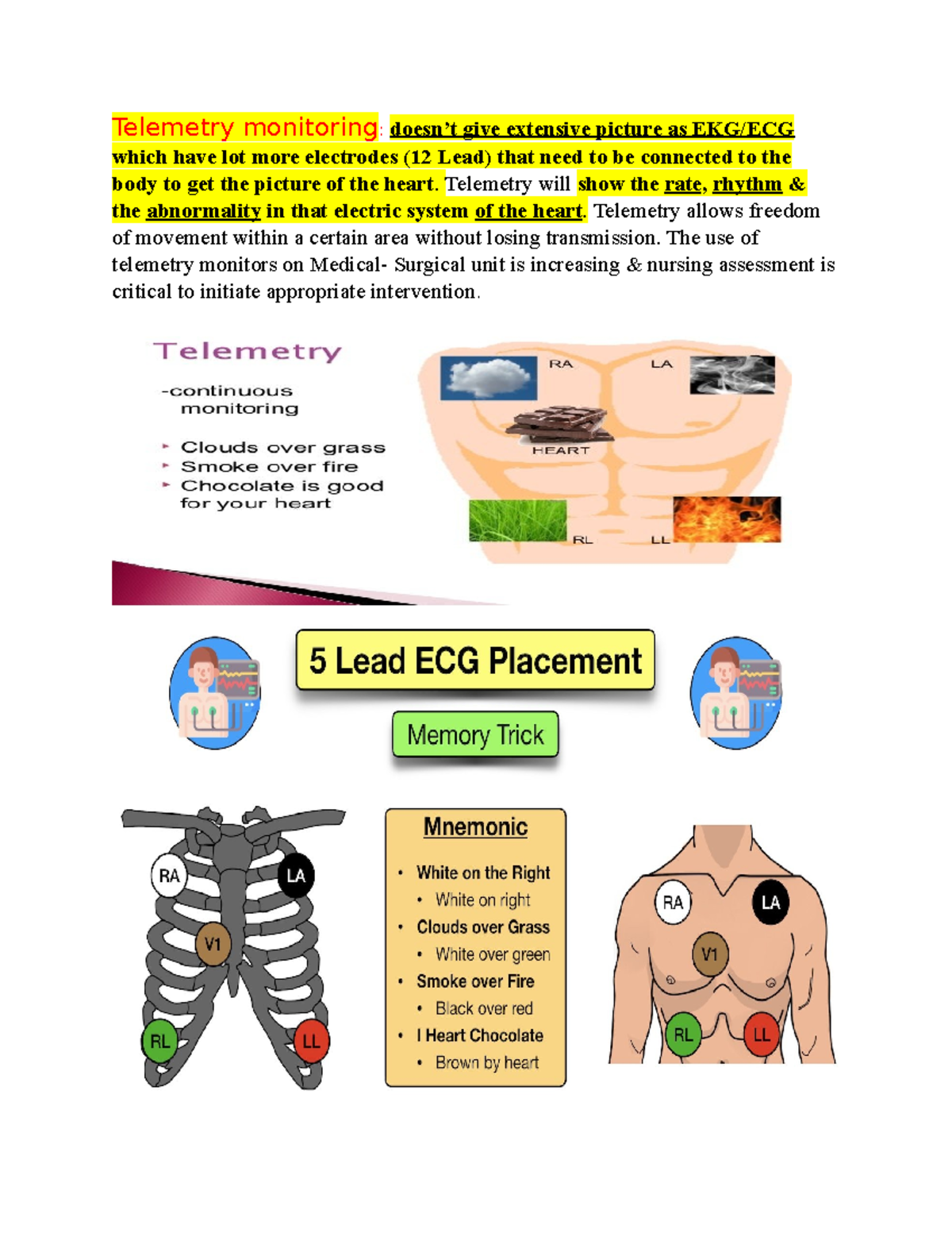 Telemetry - Telemetry will show the rate, rhythm & the abnormality in ...