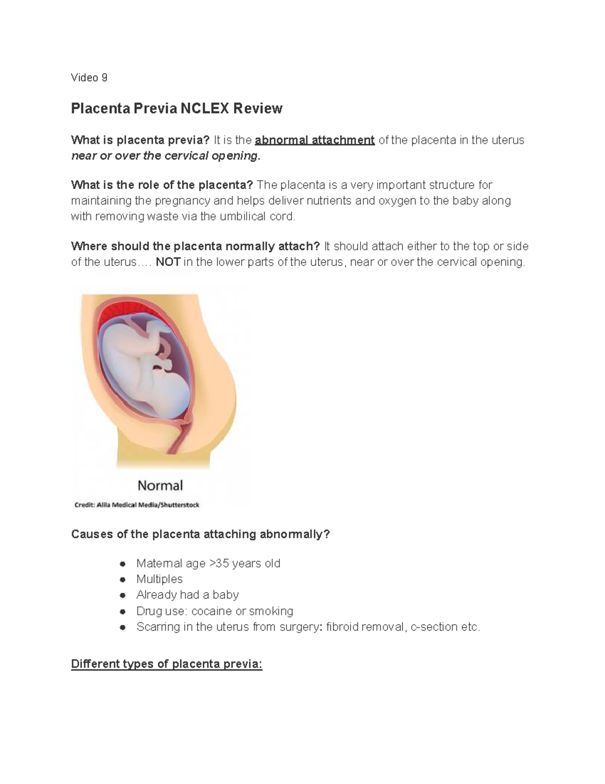 Video 9: Placenta Previa NCLEX Review and Key Insights - Studocu