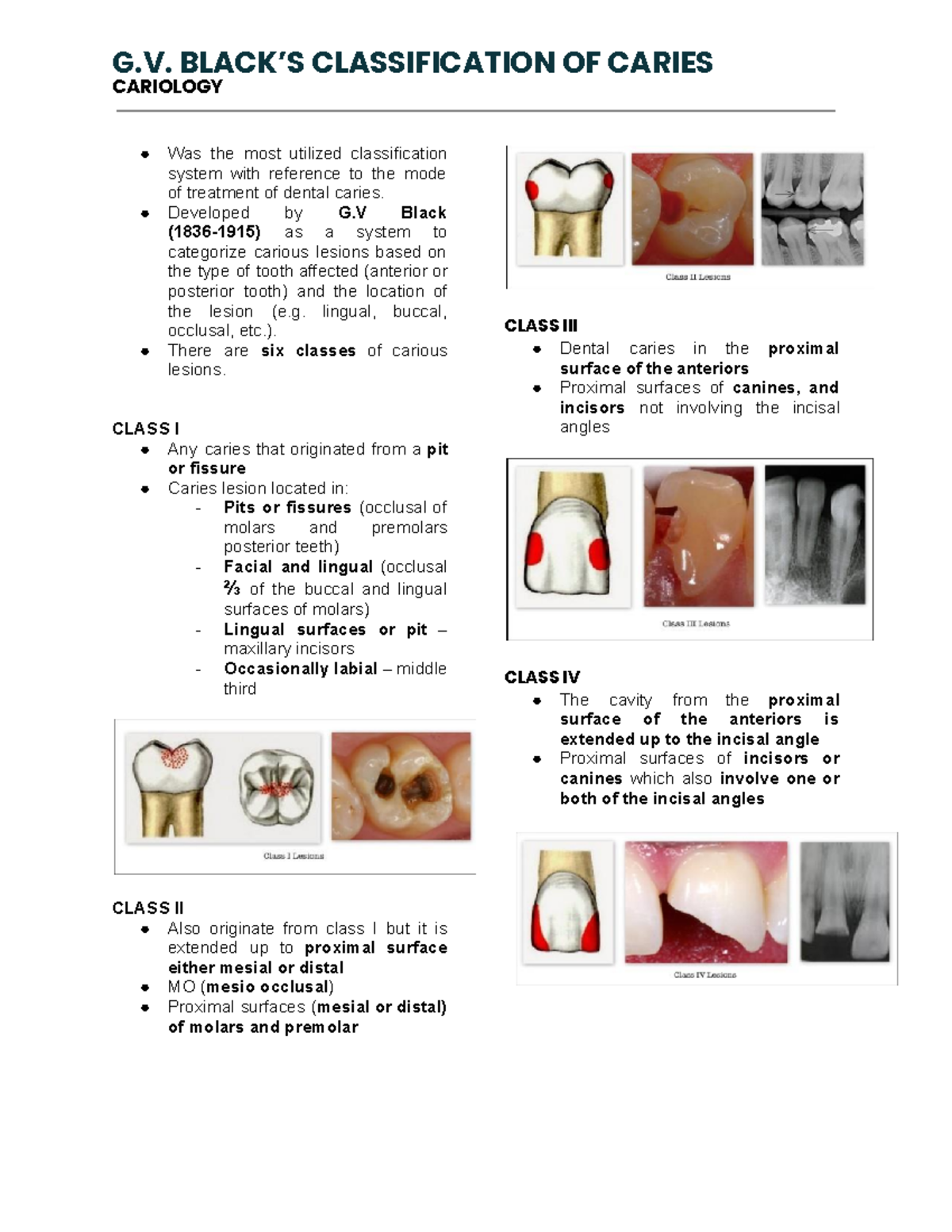 G.V. Black's Classification of Caries: A Detailed Overview - Studocu