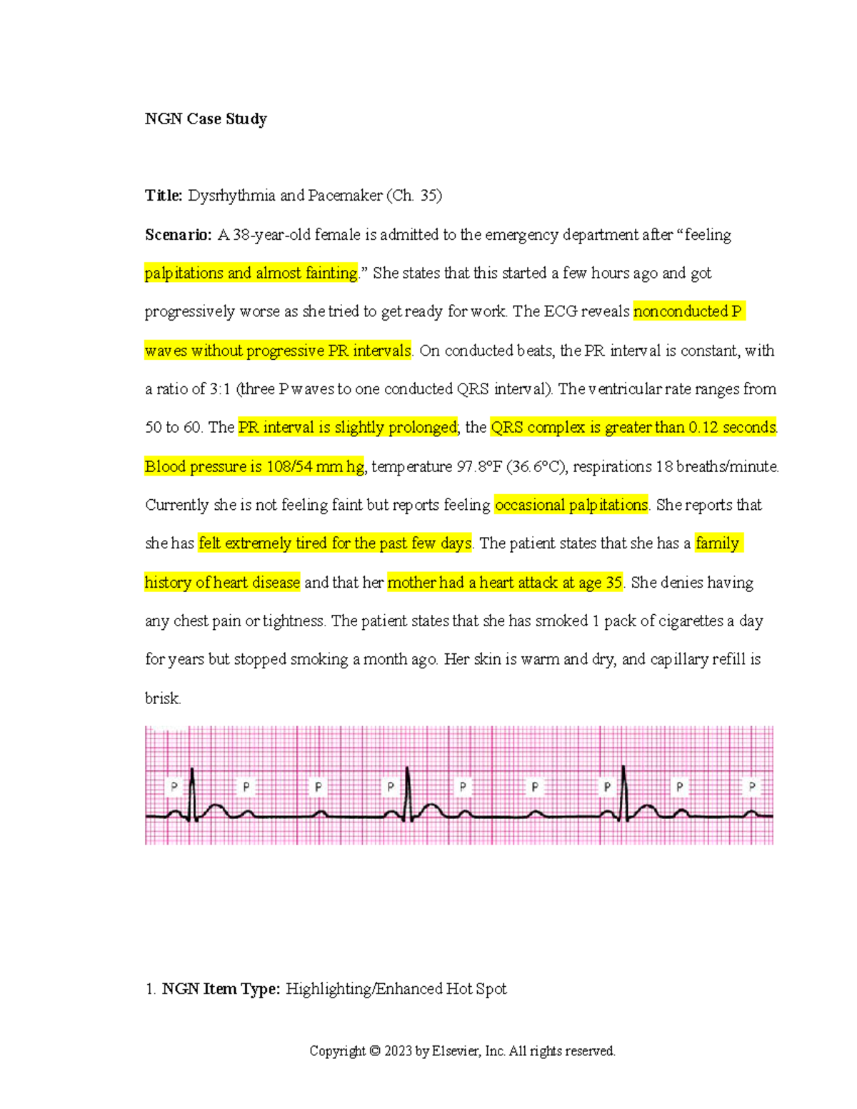 Dysrhythmia & Pacemakers (NGN Case Study) - NCLEX Prep Questions - Studocu